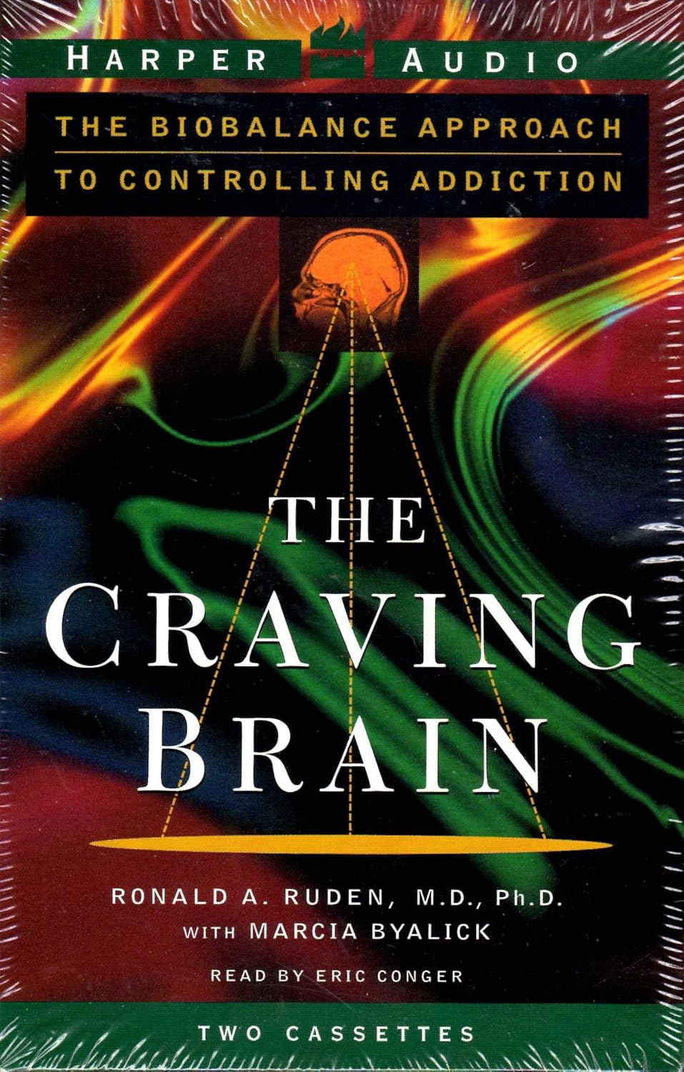 The Craving Brain: The Biobalance Approach to Controlling Addiction ...