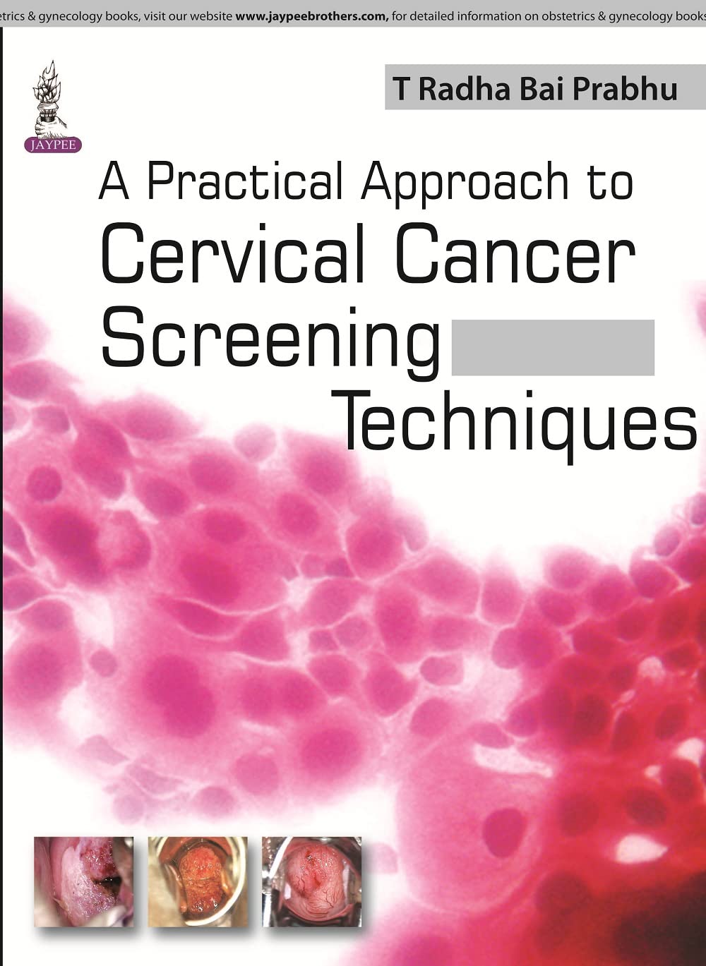 A Practical Approach to Cervical Cancer Screening Techniques: Amazon.co ...