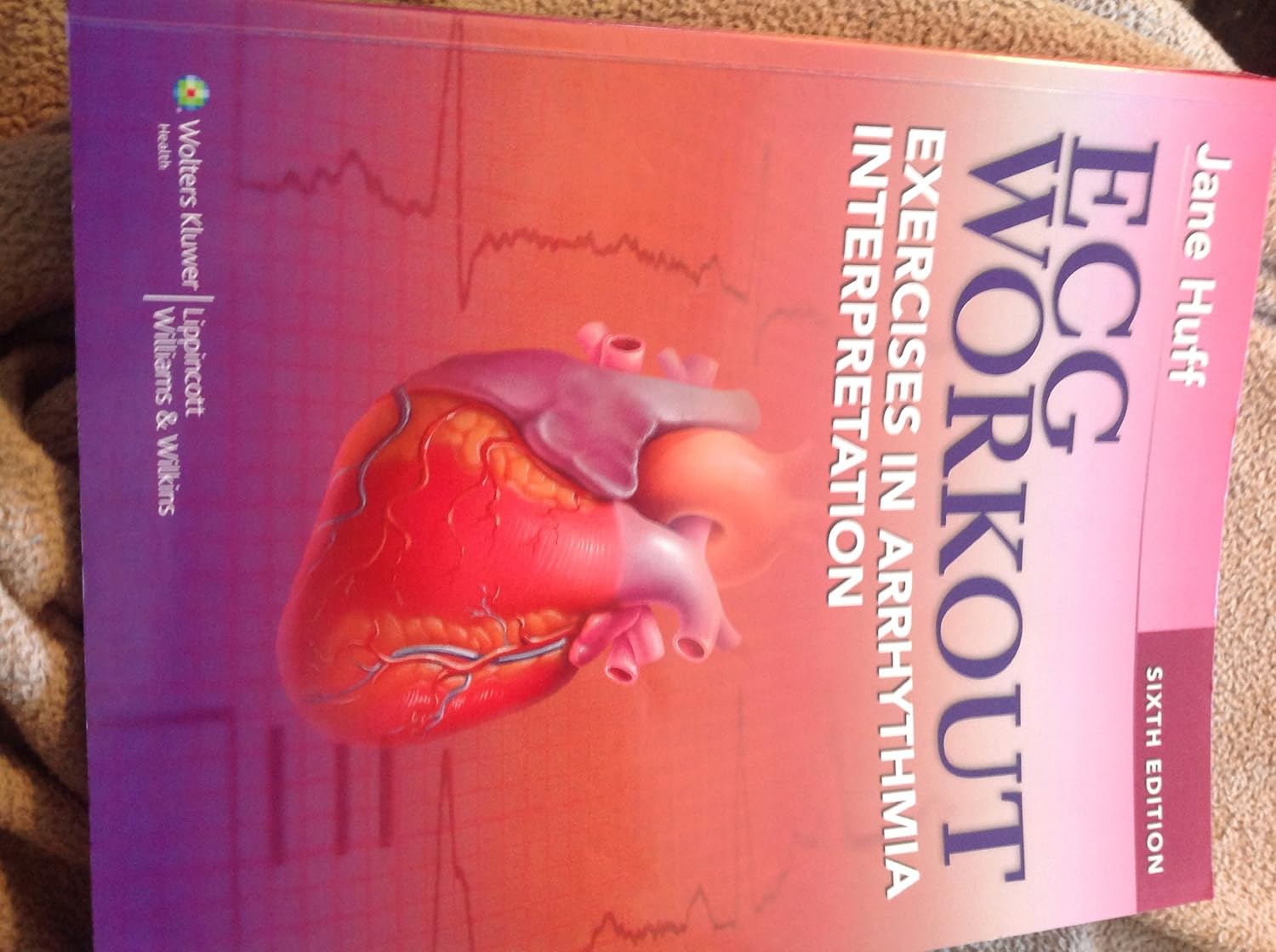 ECG Workout: Exercises in Arrhythmia Interpretation: 9781451115536 ...
