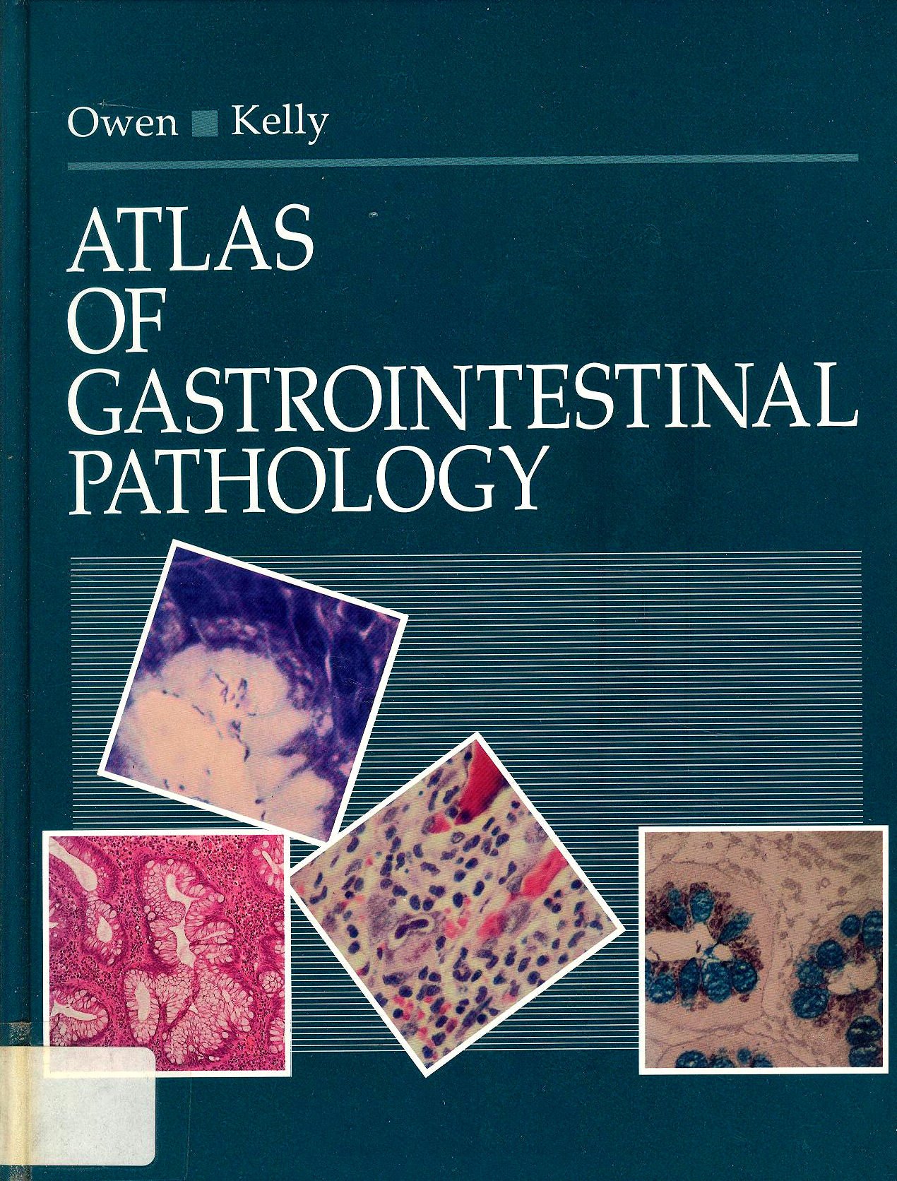 Amazon | Atlas of Gastrointestinal Pathology: A Volume in the Atlases ...