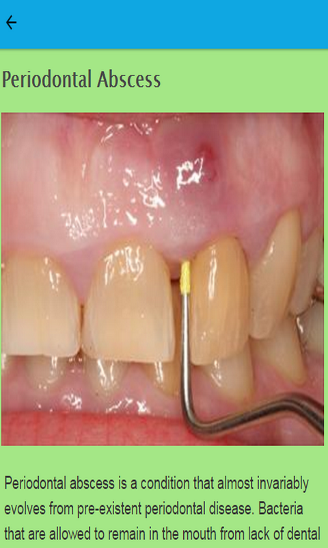 How To Treat An Abscess - App on the Amazon Appstore