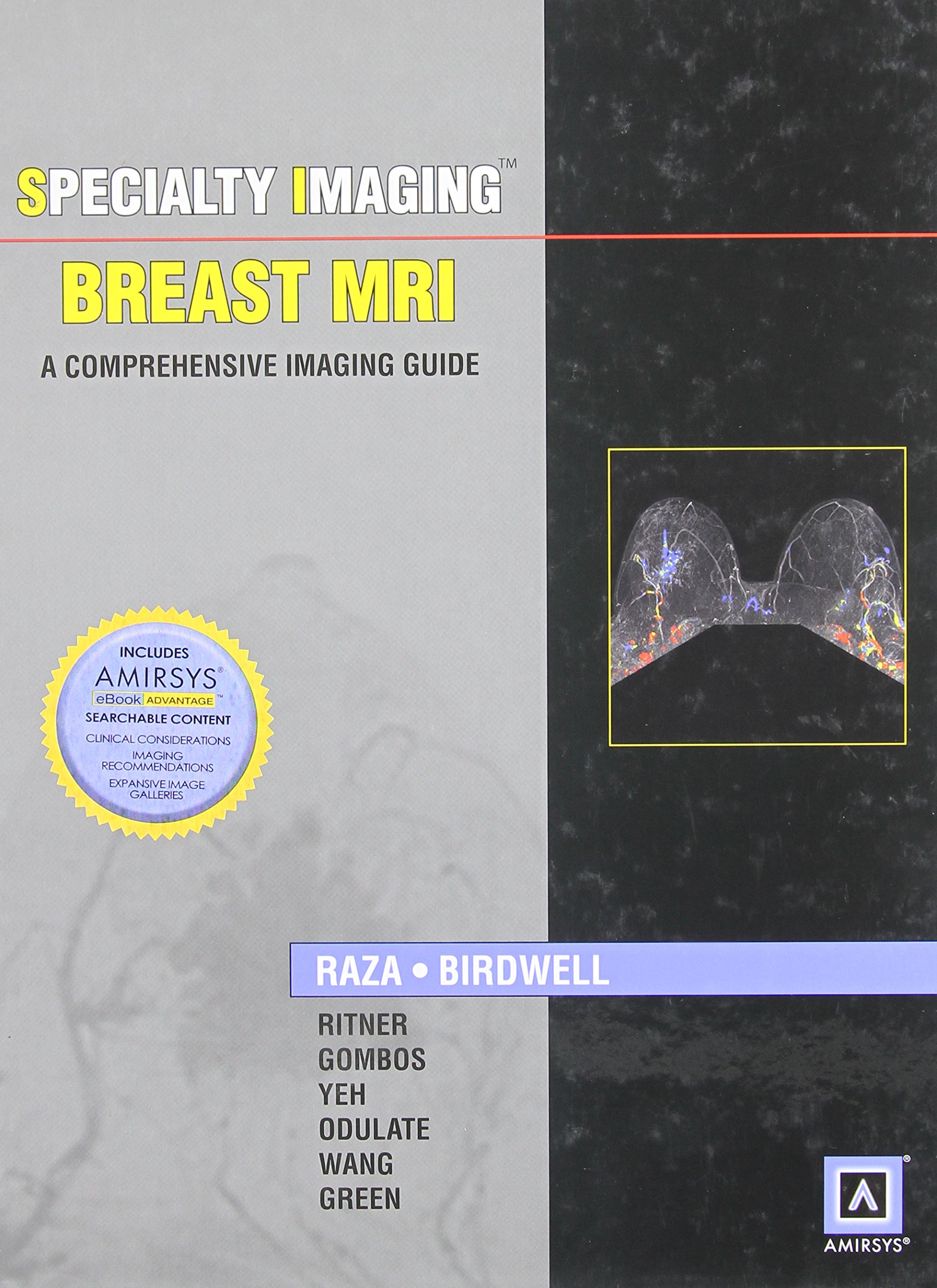 Specialty Imaging Breast MRI: A Comprehensive Imaging Guide ...