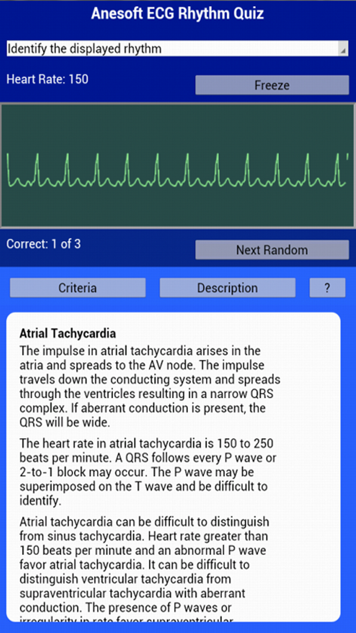 ECG Rhythms Quiz - App on Amazon Appstore