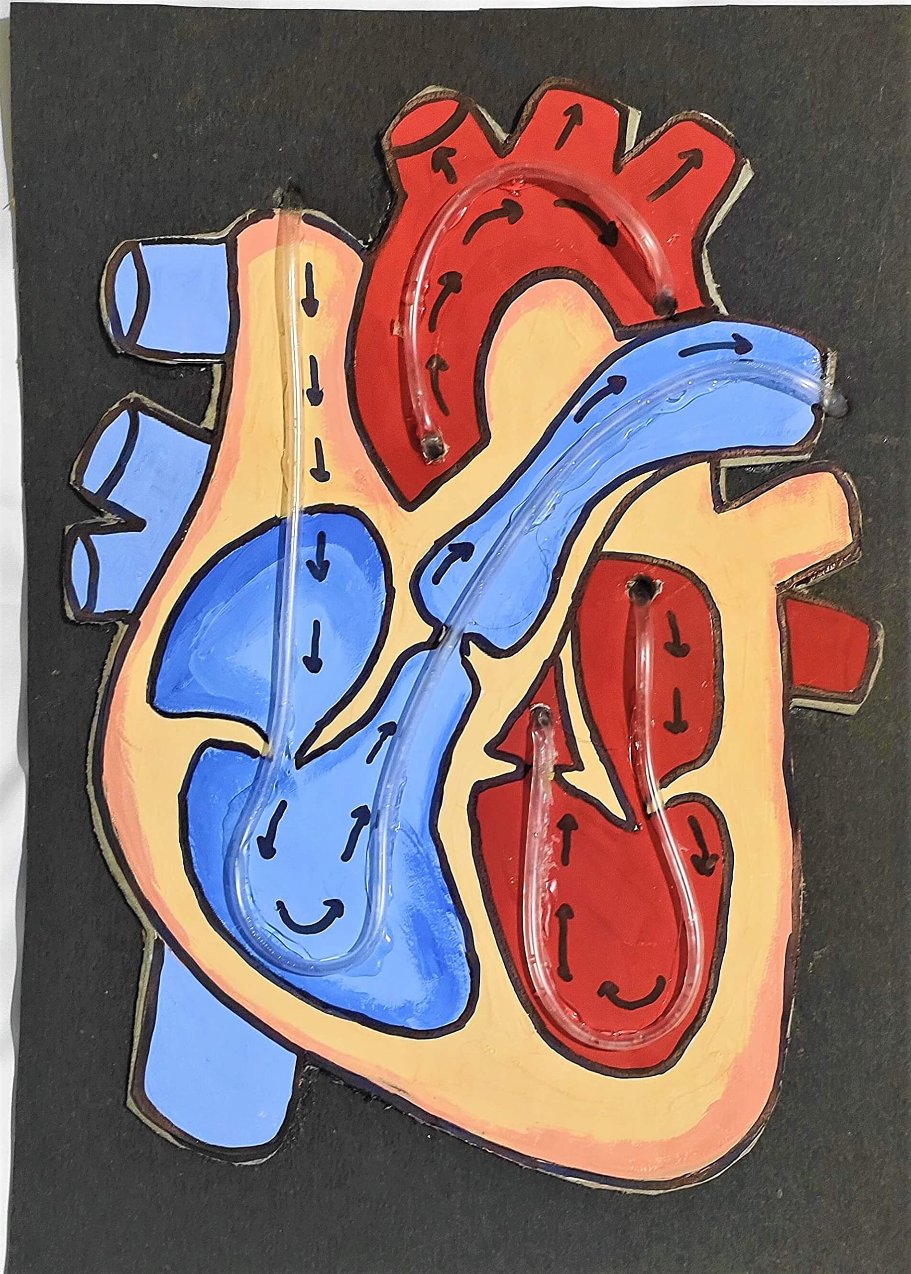 Human Heart Model Projects The Living Heart Project: A Robust And