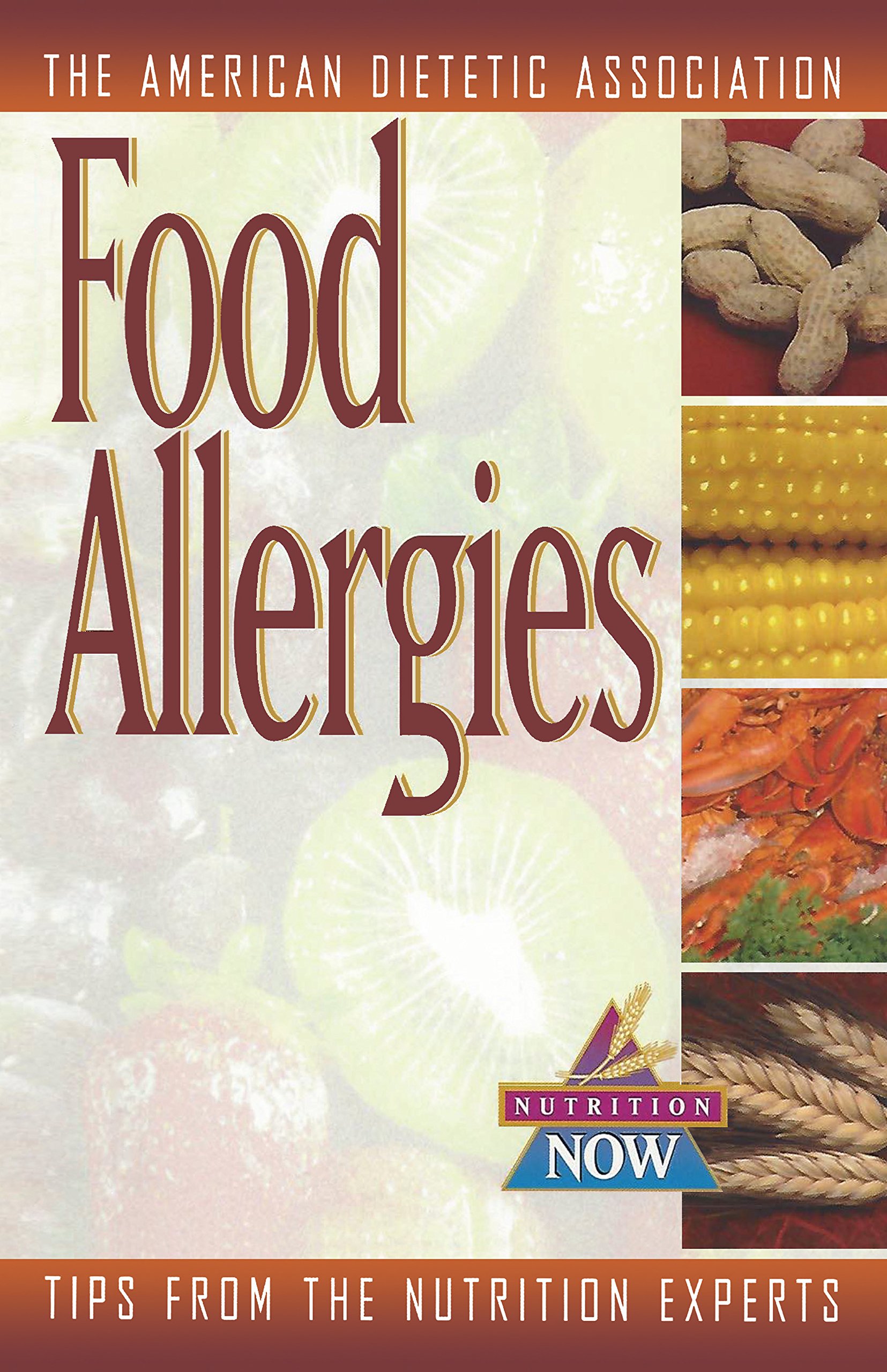 Buy FOOD ALLERGIES Book Online at Low Prices in India | FOOD ALLERGIES ...