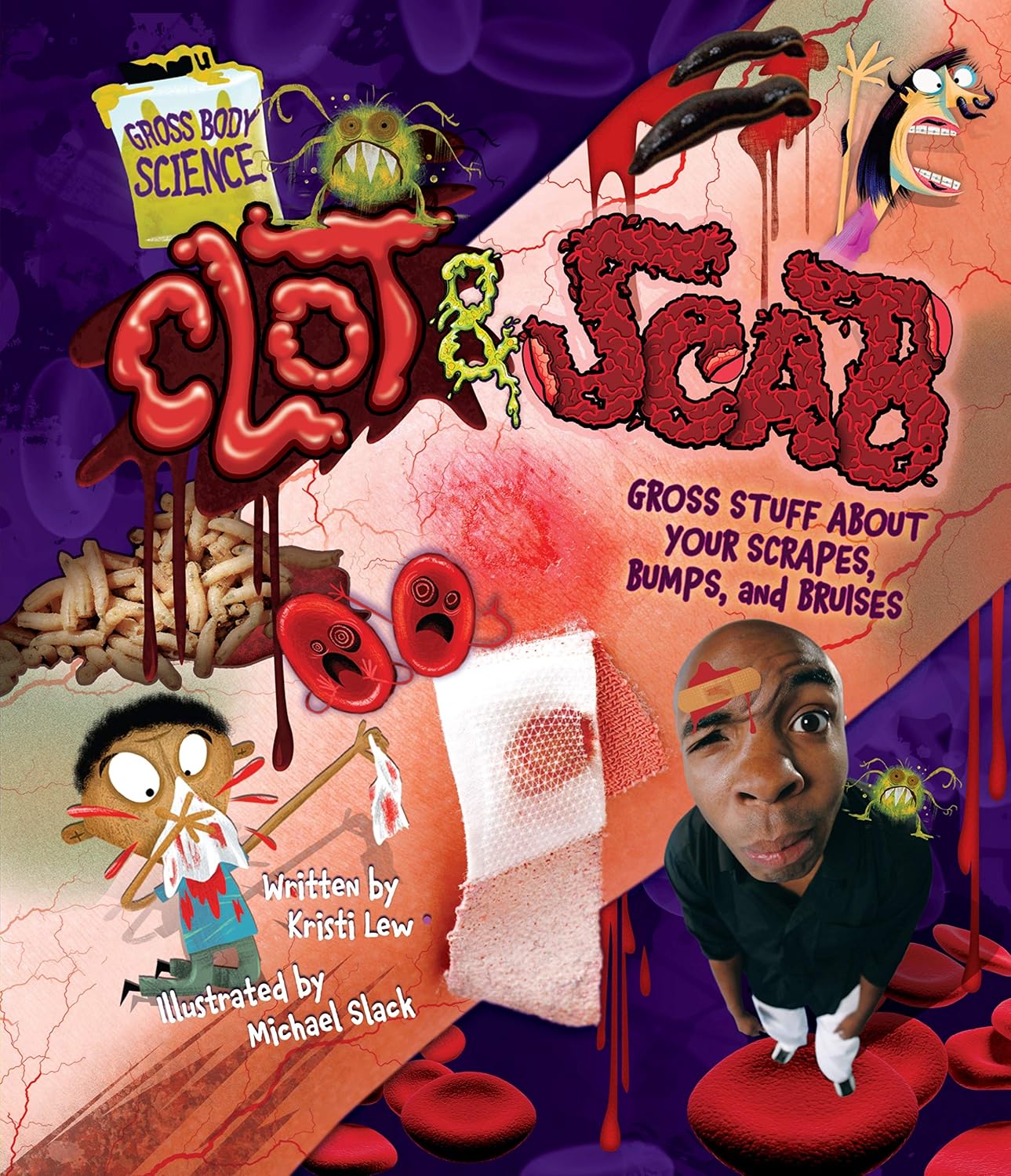 Clot & Scab: Gross Stuff about Your Scrapes, Bumps, and Bruises (Gross ...