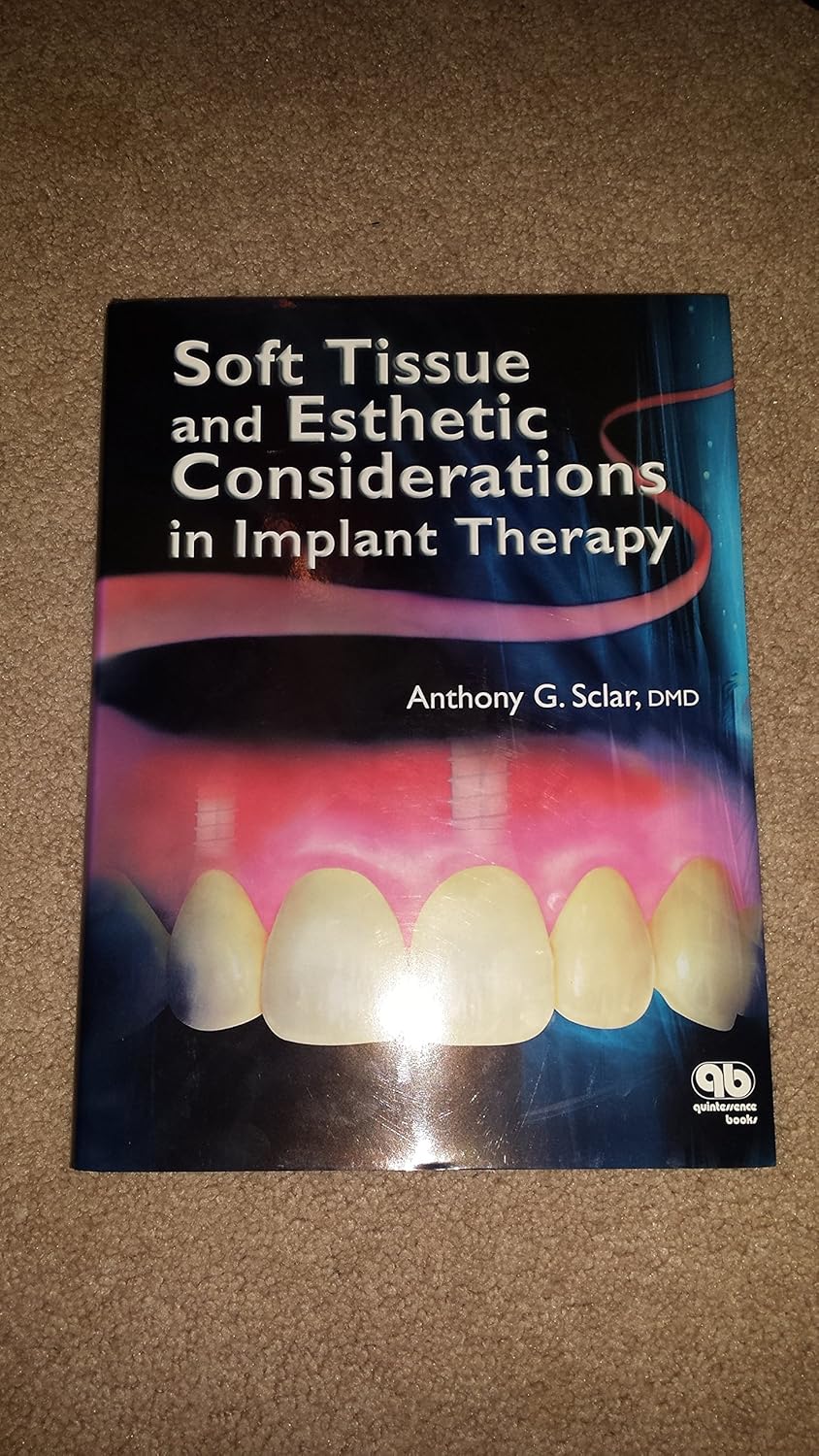 Amazon | Soft Tissue and Esthetic Considerations in Implant Therapy ...