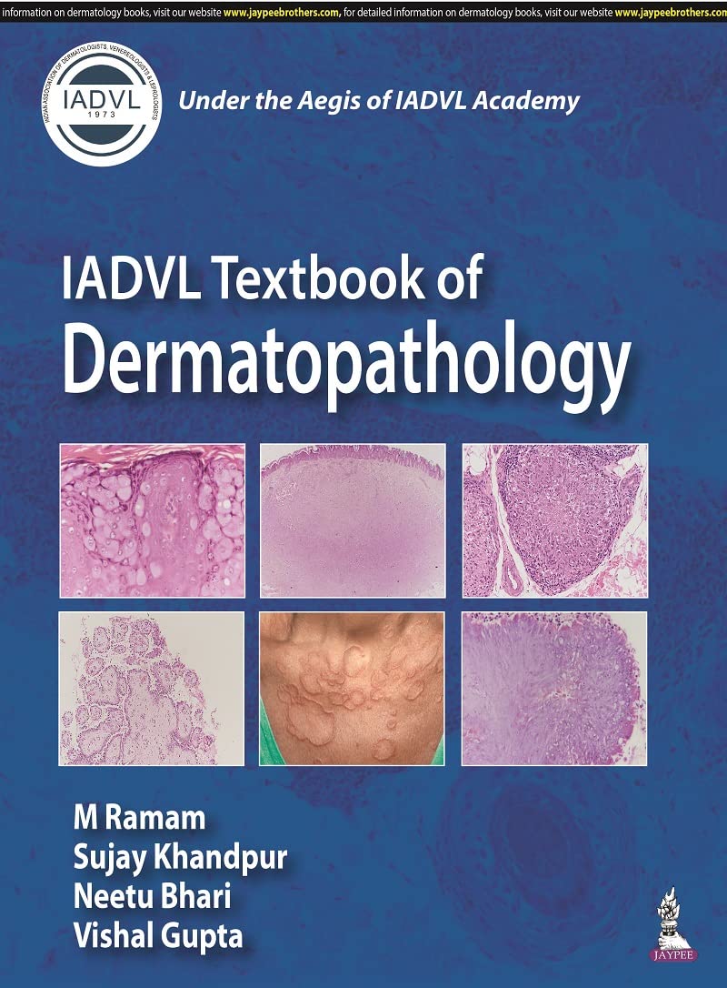 Buy IADVL Textbook of Dermatopathology Book Online at Low Prices in ...