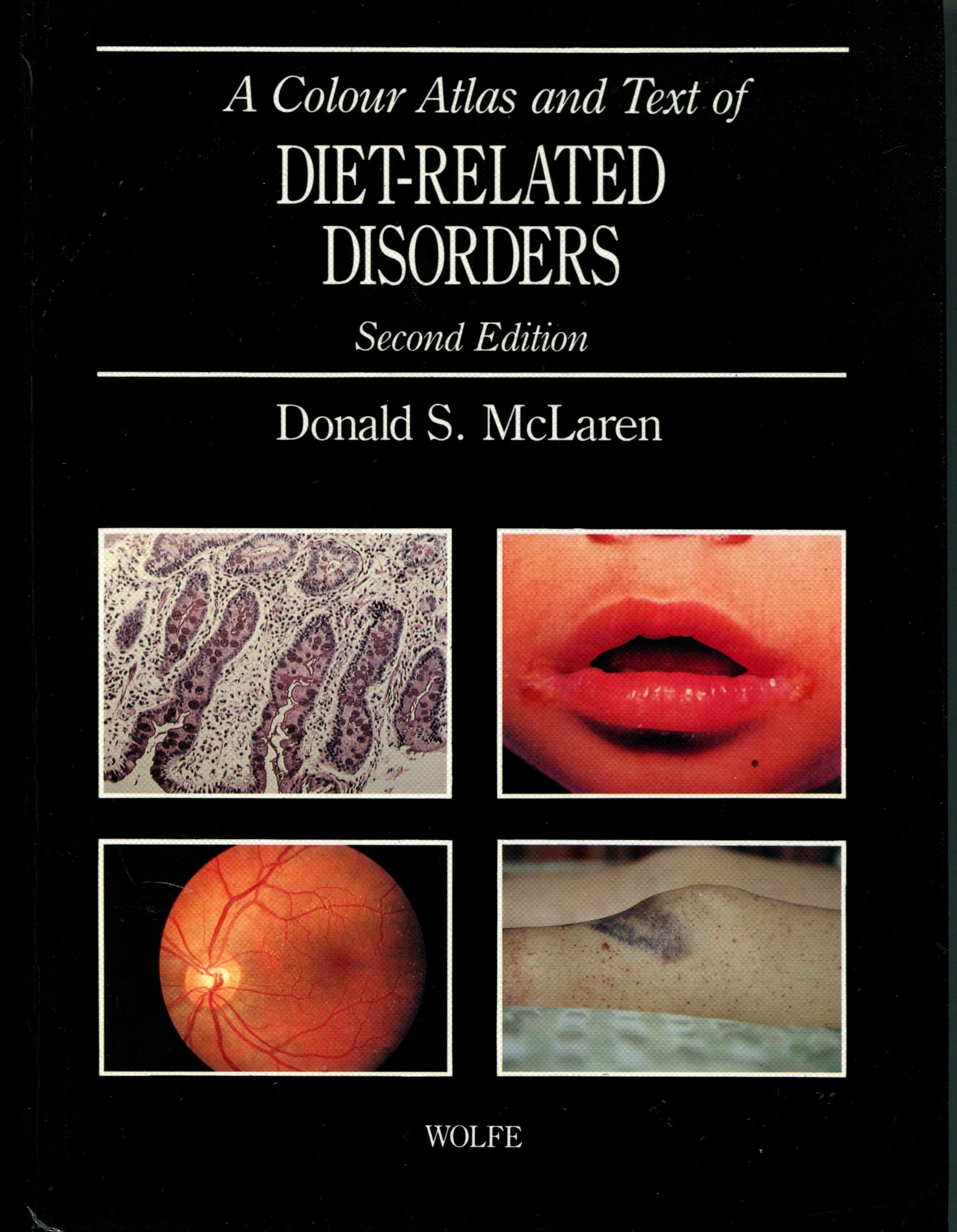 A colour atlas and text of diet-related disorders: McLaren, Donald ...
