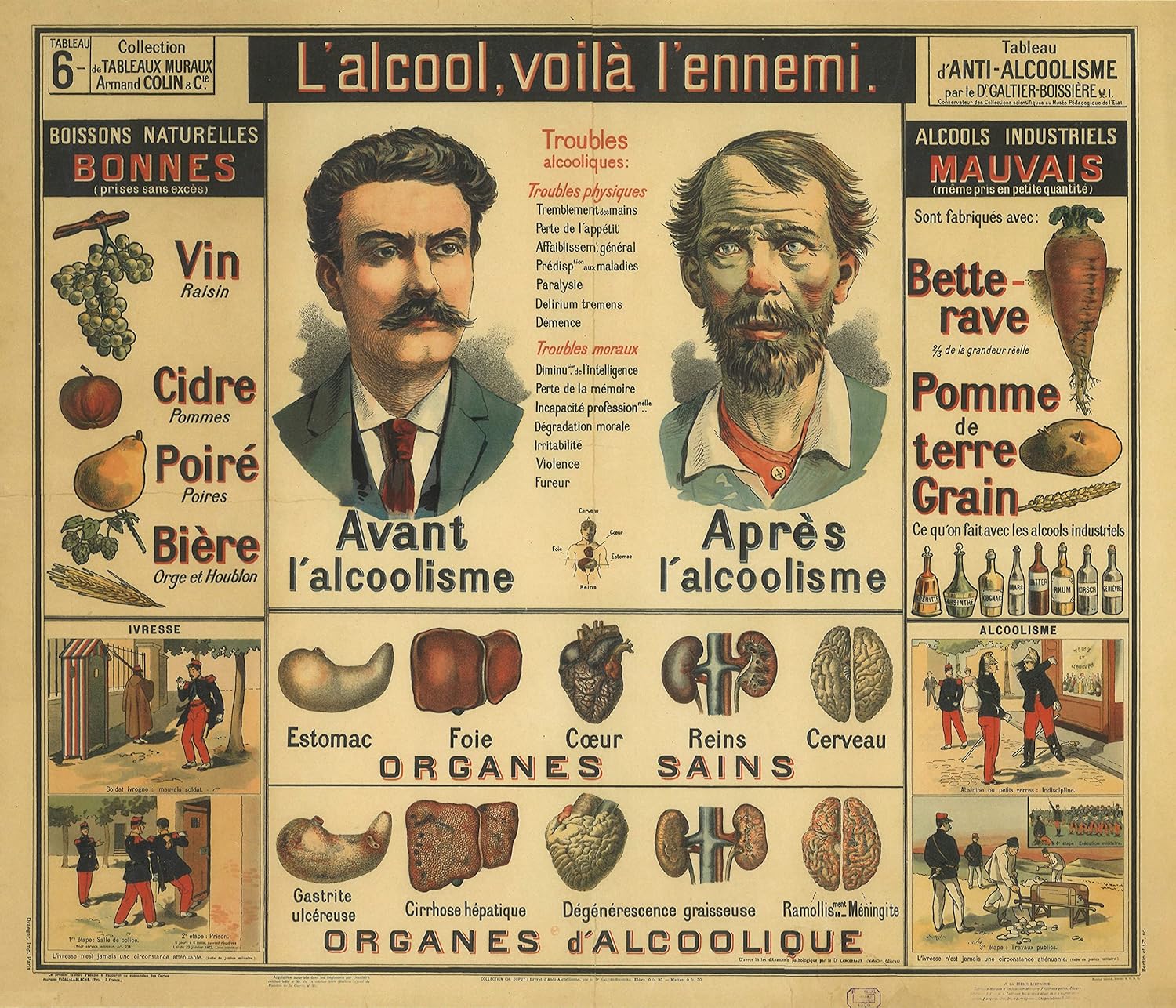 Affiche Vintage Scolaire Anatomie - L'Alcool, voilà l'ennemi - Poster ...