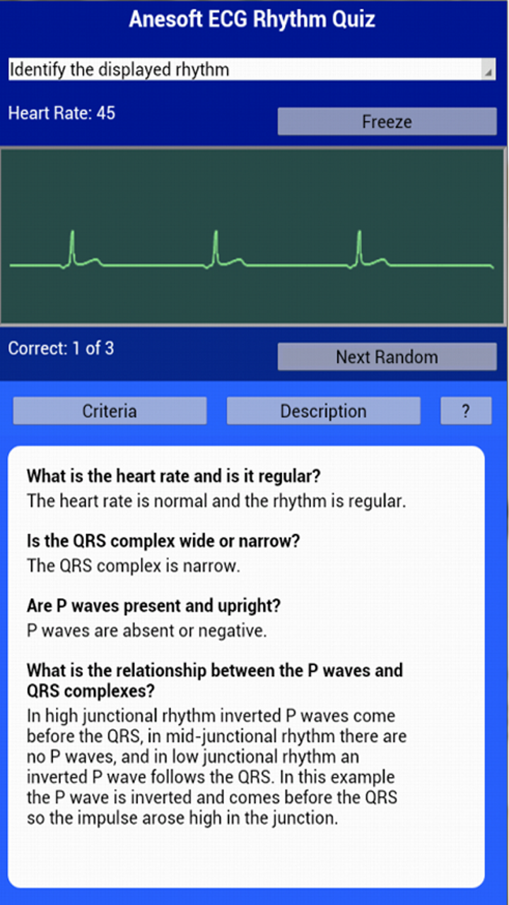ECG Rhythms Quiz - App on Amazon Appstore