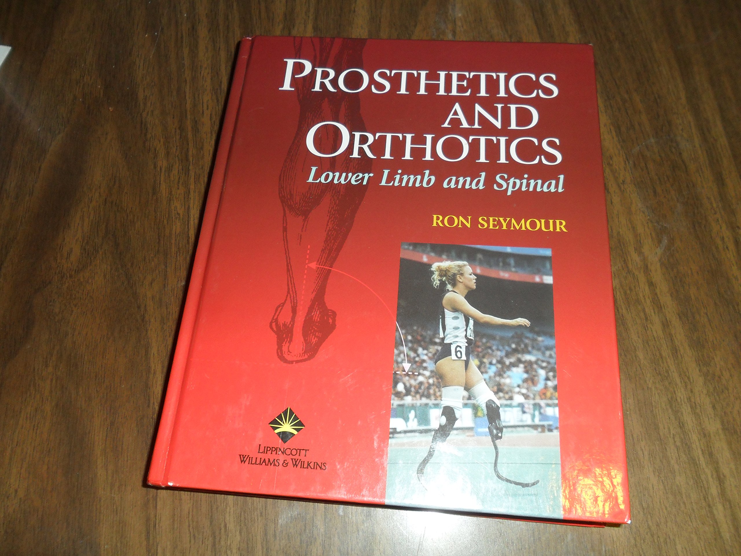 Prosthetics and Orthotics: Lower Limb and Spine: 9780781728546 ...