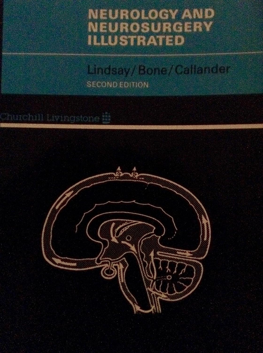 Amazon | Neurology and Neurosurgery Illustrated | Lindsay, Kenneth W ...