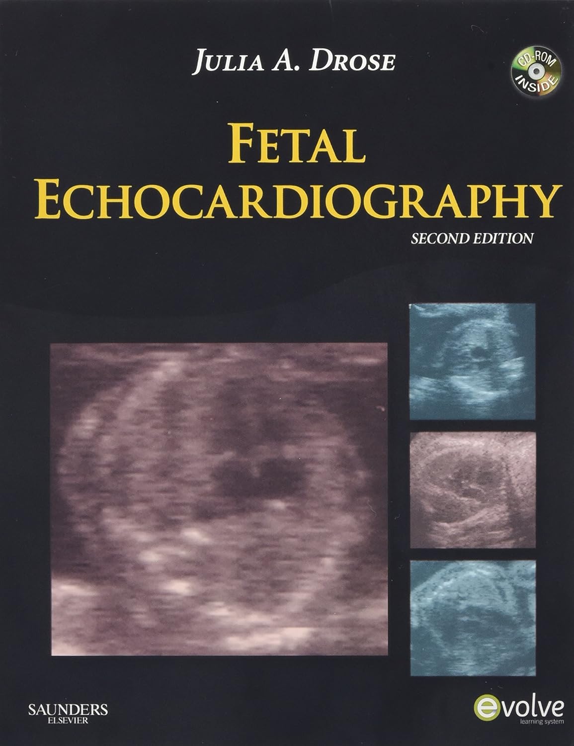 Fetal Echocardiography: 9781416056690: Medicine & Health Science Books ...