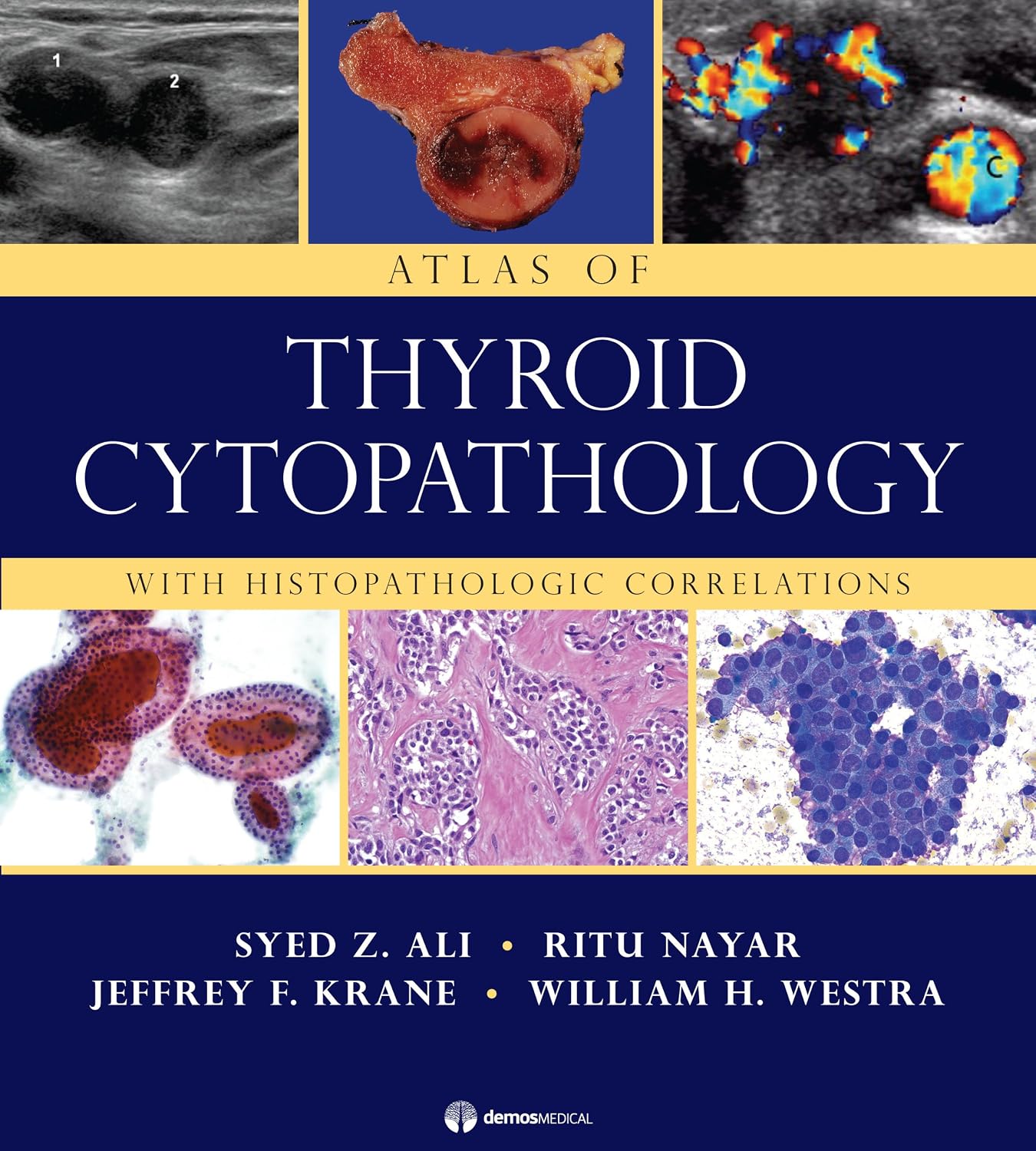 Atlas of Thyroid Cytopathology: With Histopathologic Correlations ...