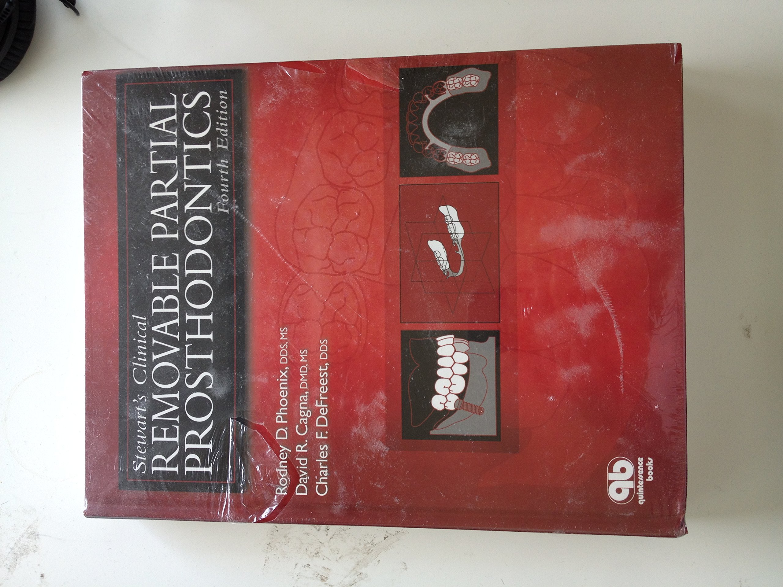 Stewart's Clinical Removable Partial Prosthodontics: 9780867154856 ...
