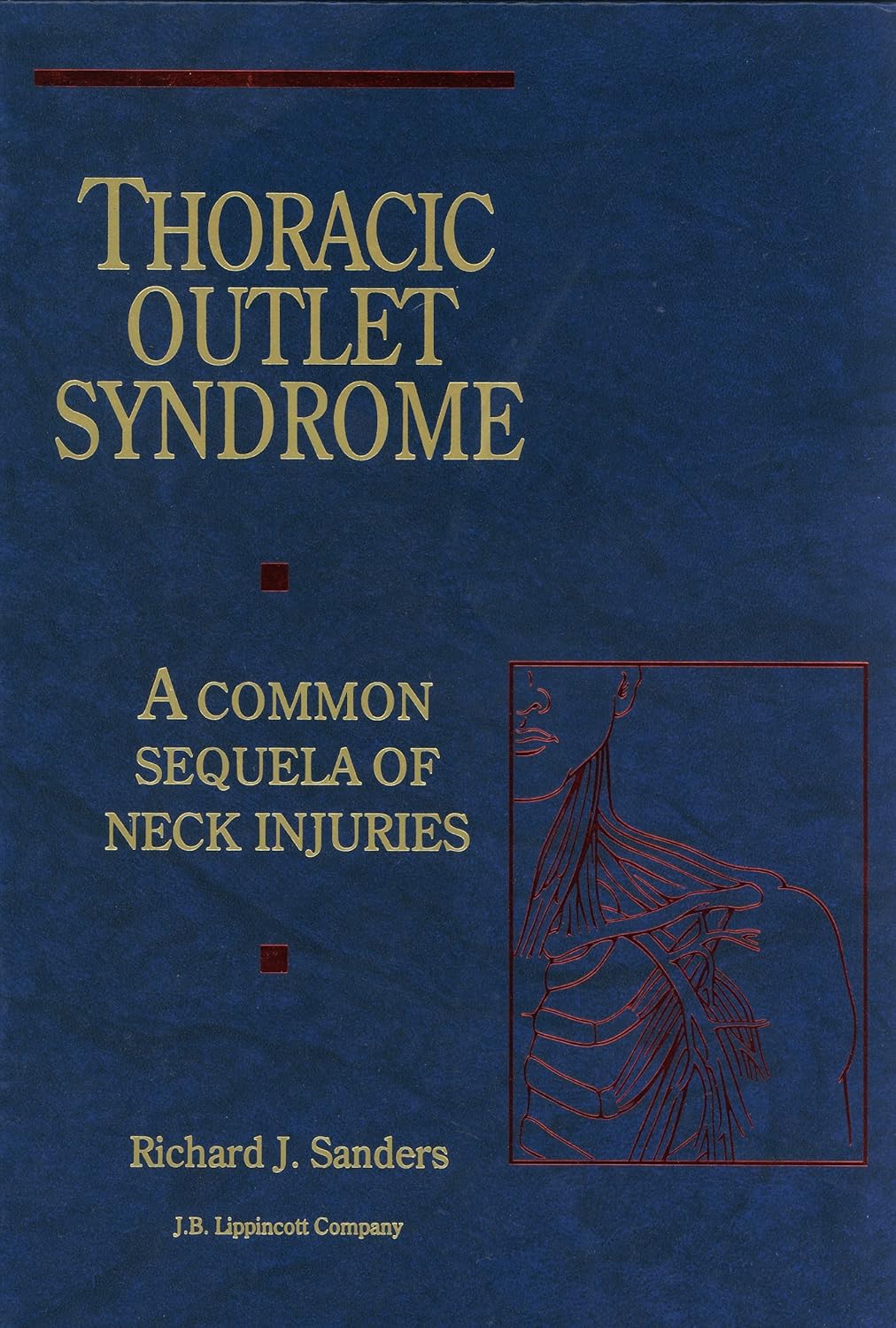Amazon.com: Thoracic Outlet Syndrome: A Common Sequela of Neck Injuries ...