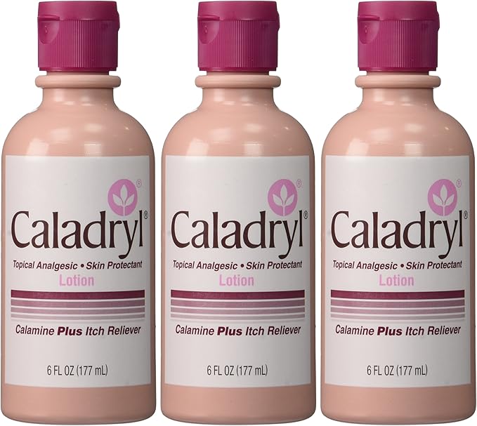 Caladryl Lotion, Calamine Plus Itch Reliever, 6-Ounce Bottles (Pack of ...
