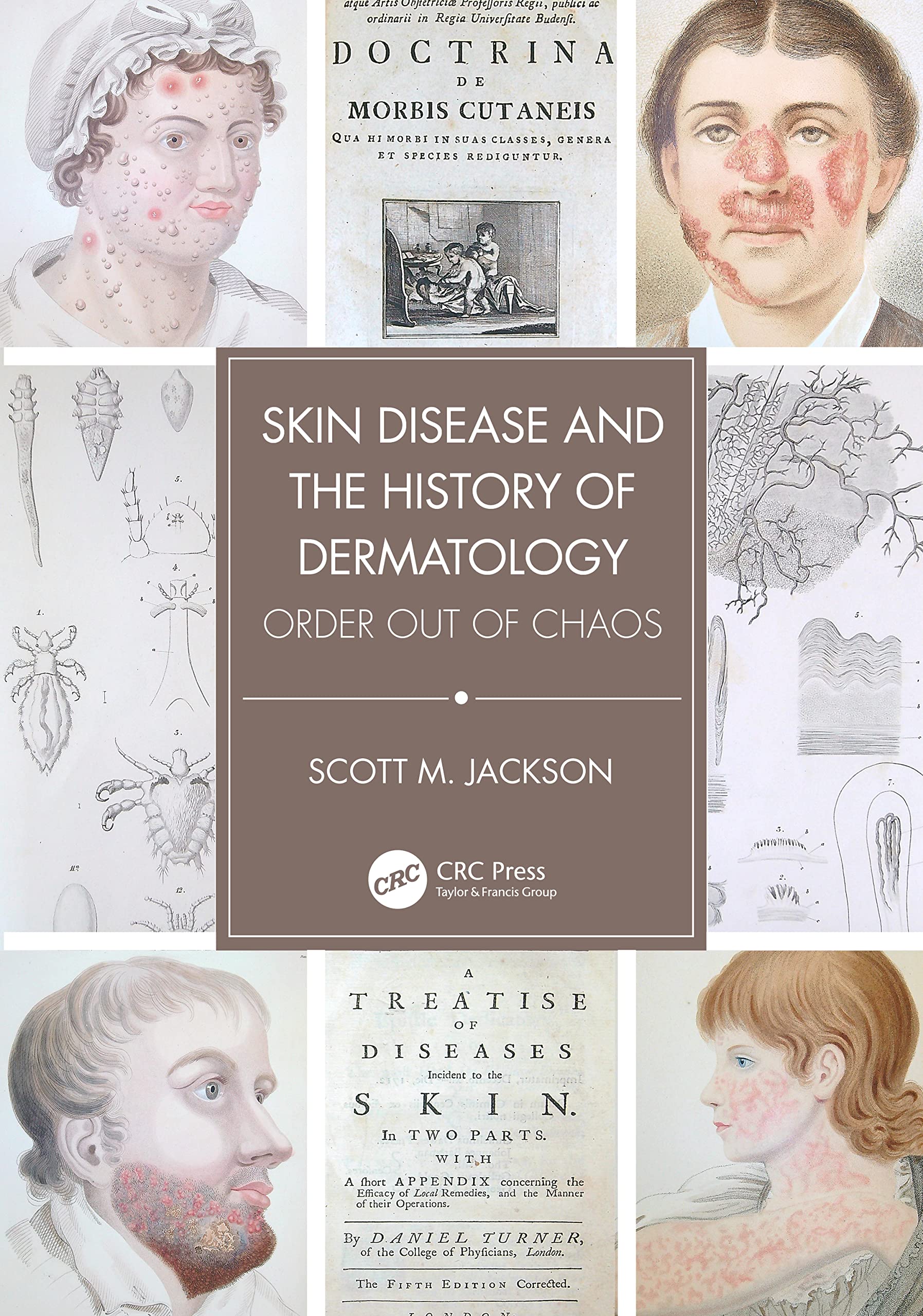 Skin Disease and the History of Dermatology: 9781032226606: Medicine ...