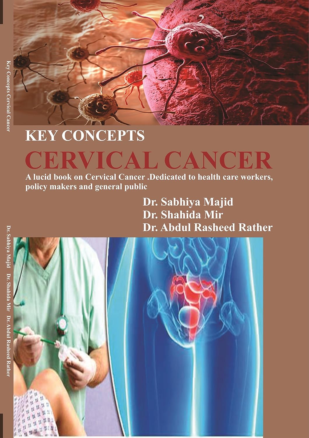 Buy KEY CONCEPTS CERVICAL CANCER Book Online at Low Prices in India ...