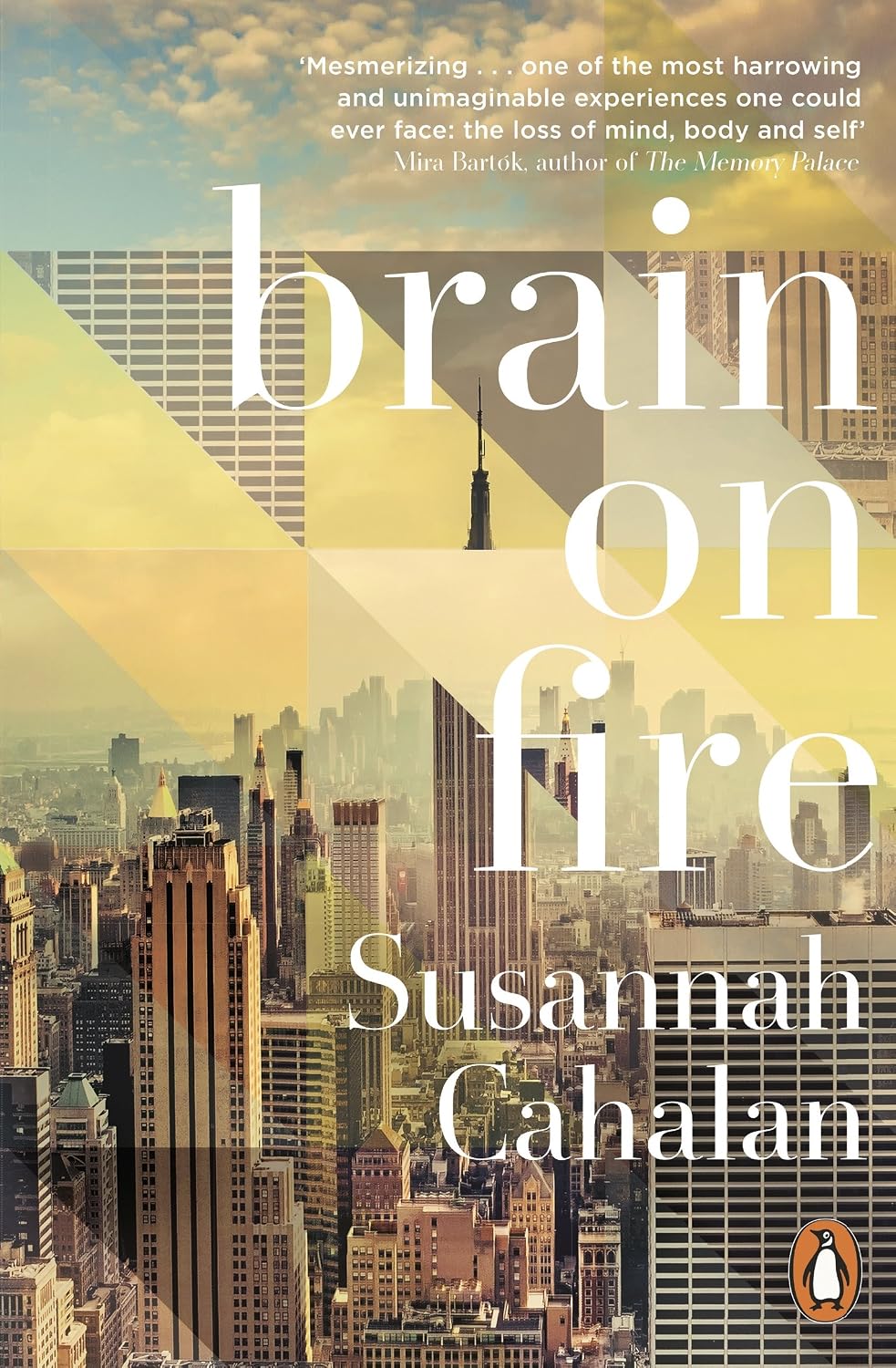 Brain On Fire: My Month of Madness eBook : Cahalan, Susannah: Amazon ...