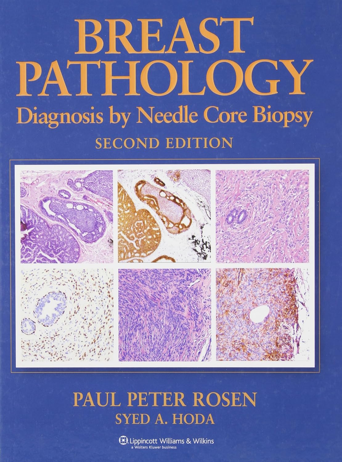 Breast Pathology: Diagnosis by Needle Core Biopsy: Rosen, Paul Peter ...