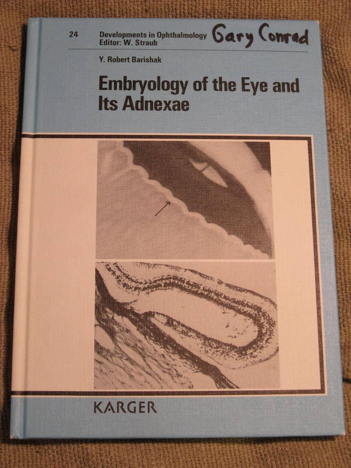 Embryology of the Eye and Its Adnexae (Developments in Ophthalmology ...