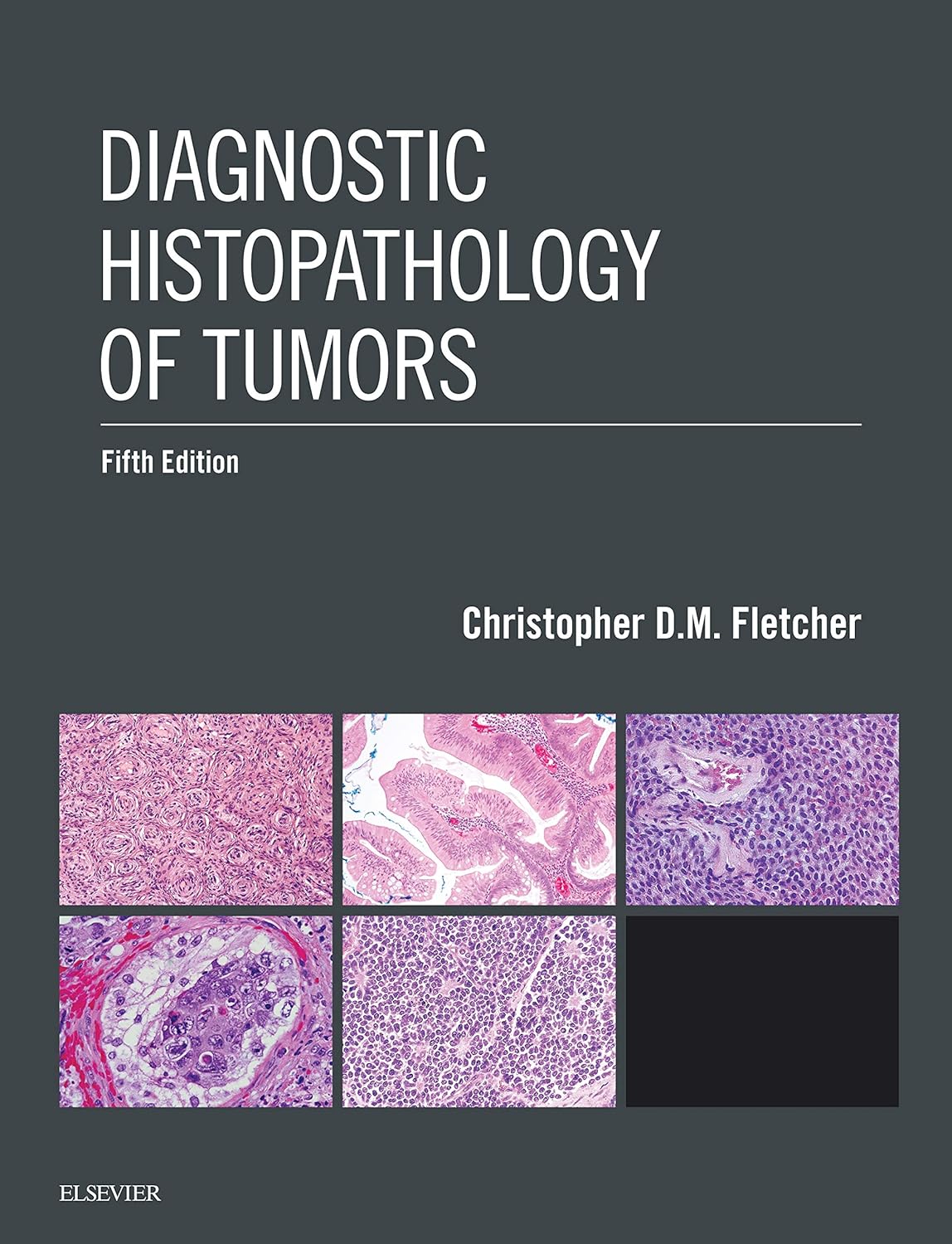 Diagnostic Histopathology of Tumors E-Book: Expert Consult - Online and ...