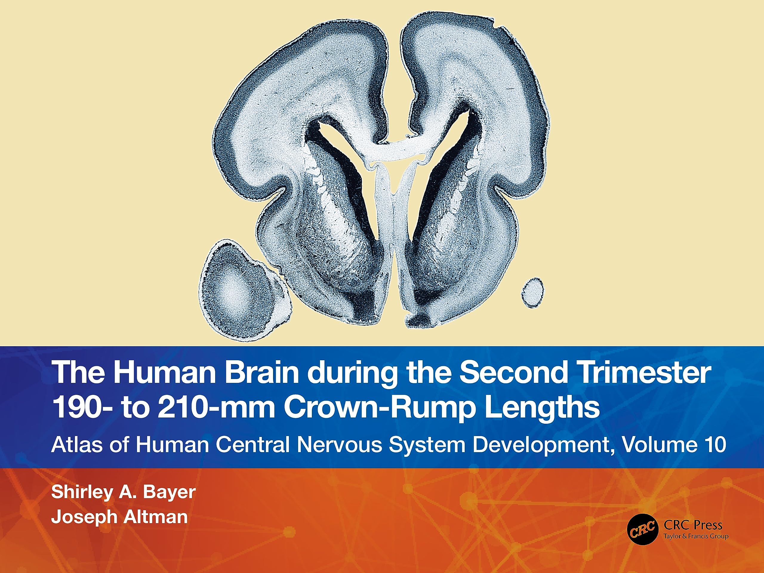 Buy The Human Brain during the Second Trimester 190– to 210–mm Crown ...