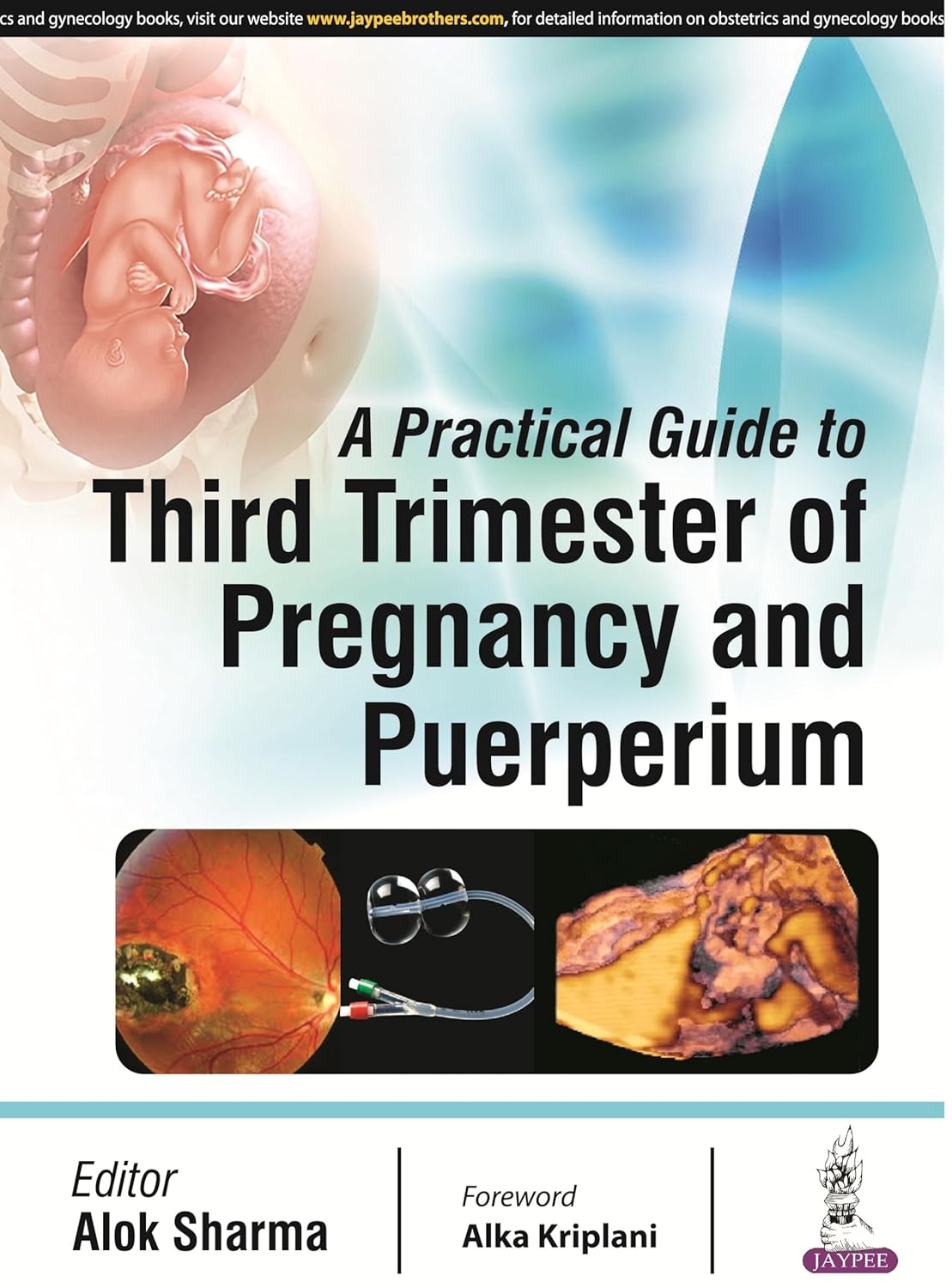 A Practical Guide to Third Trimester of Pregnancy & Puerperium ...