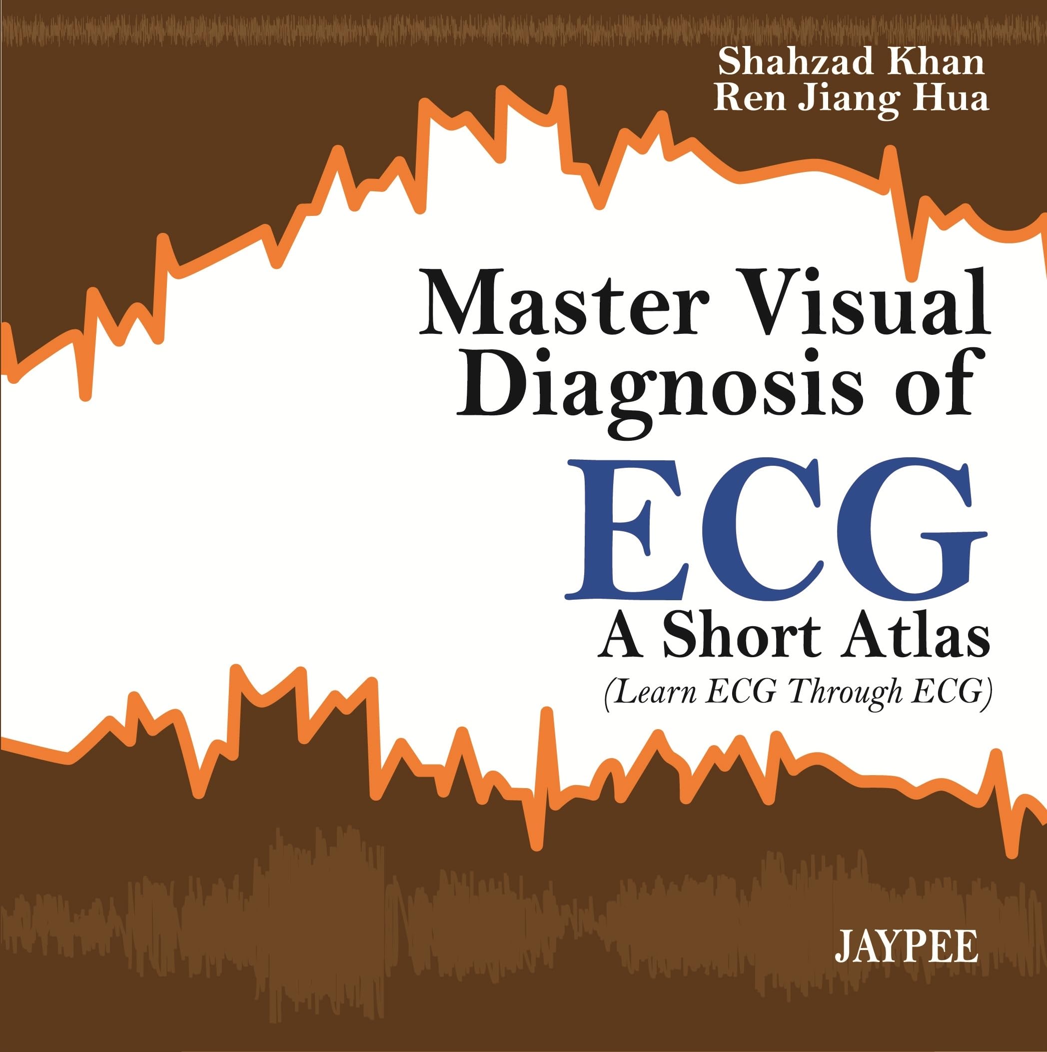 Master Visual Diagnosis of ECG: A Short Atlas (Learn ECG Through ECG ...