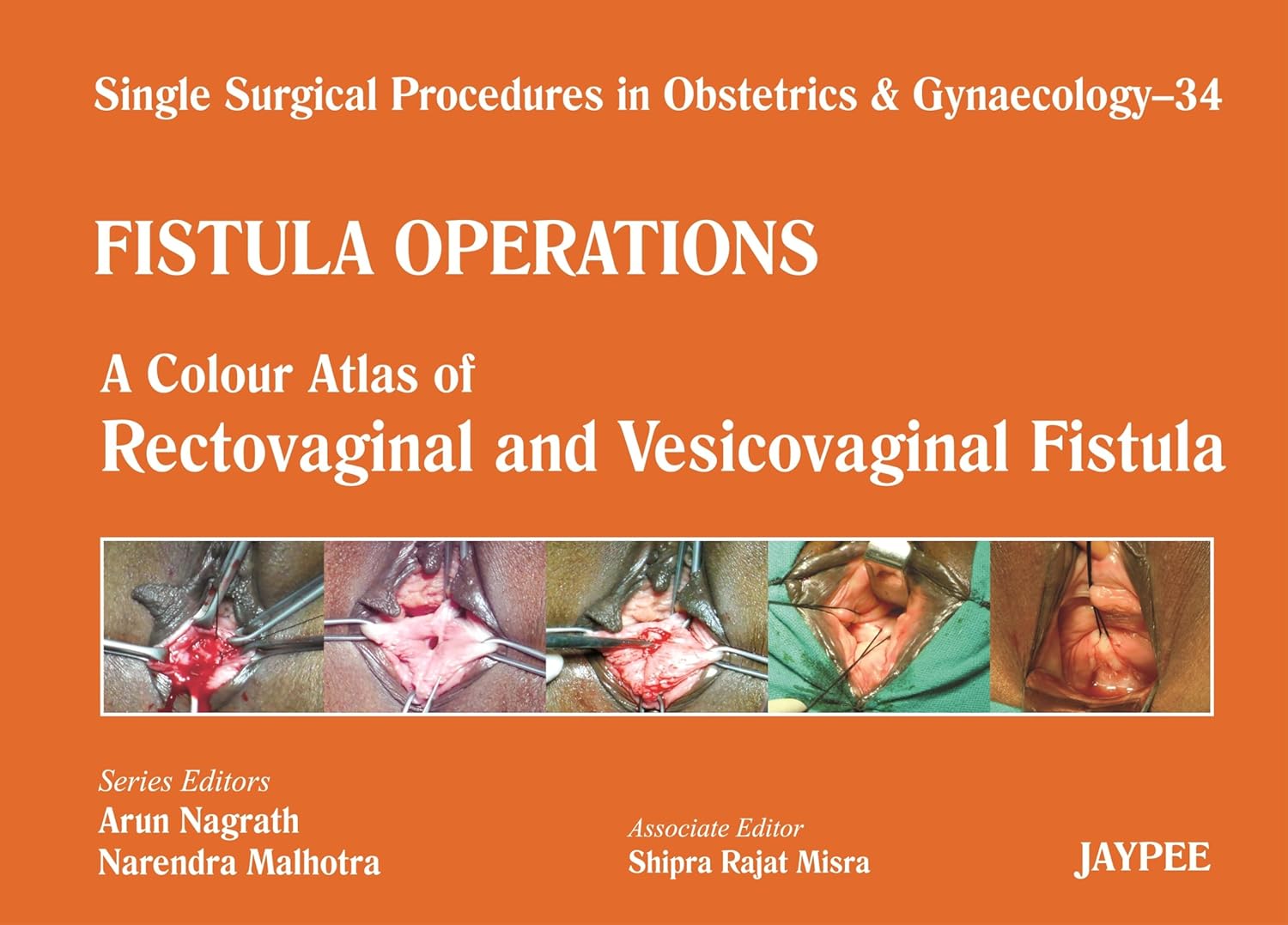 Fistula Operations: A Colour Atlas of Rectovaginal and Vesicovaginal ...