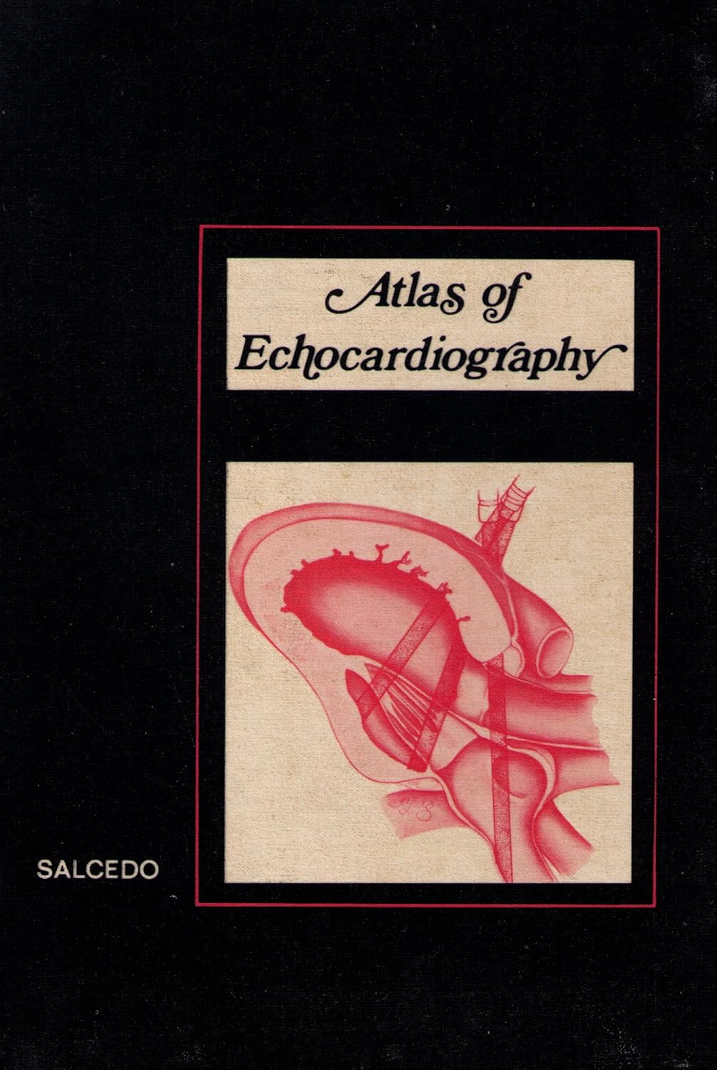 Atlas of echocardiography: Salcedo, Ernesto E: 9780721679013: Amazon ...