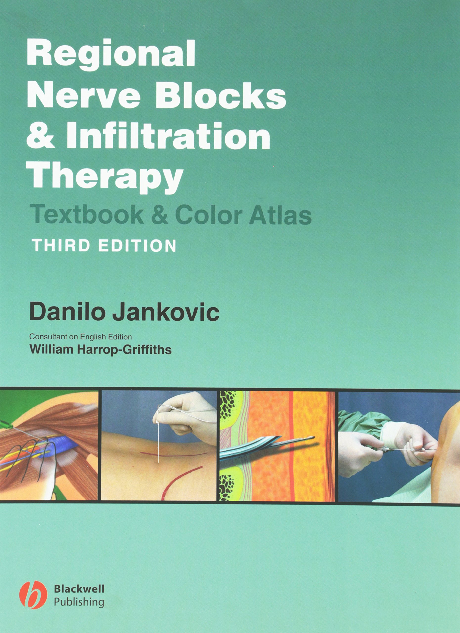 Buy Regional Nerve Blocks And Infiltration Therapy: Textbook and Color ...