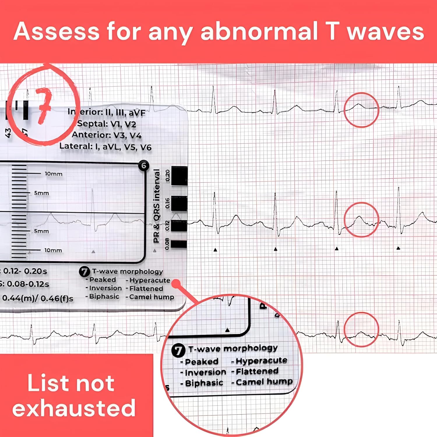 ECG 7 Step Ruler, ECG Ruler Transparent, ECG Australia | Ubuy