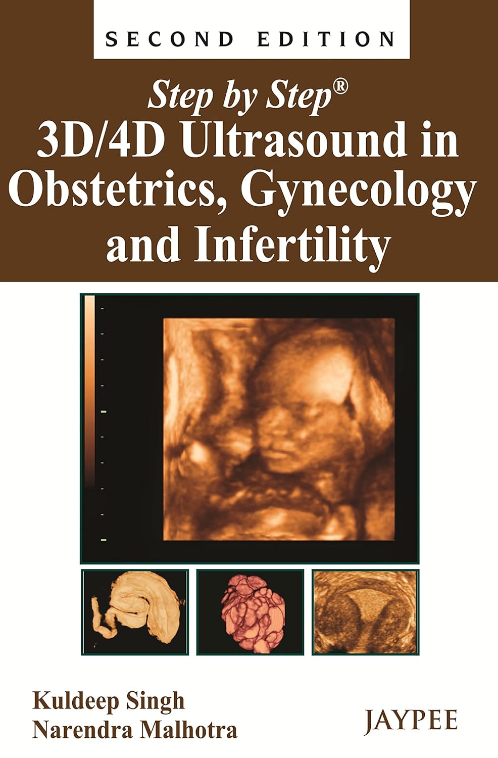 Buy Step by Step 3D/4D in Ultrasound in Obstetrics, Gynecology and ...