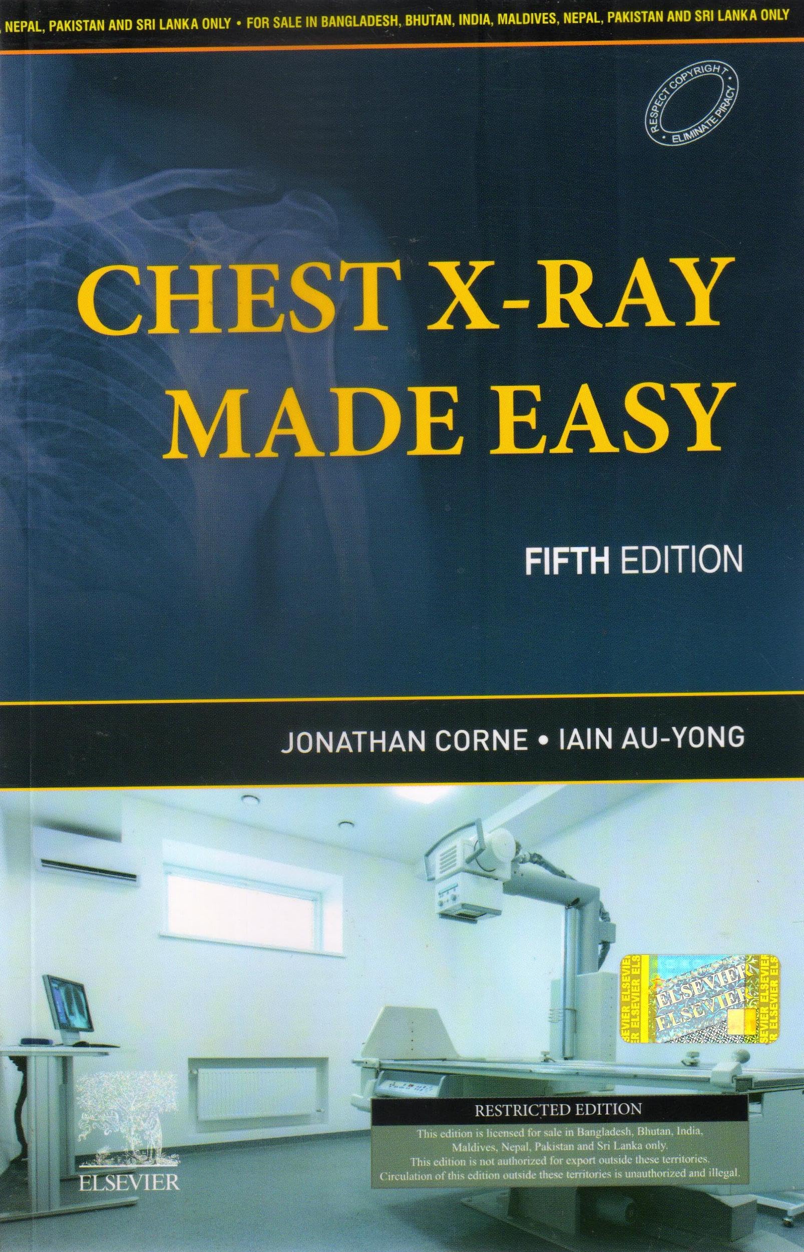 Buy Chest X-Ray Made Easy, 5e Book Online at Low Prices in India ...