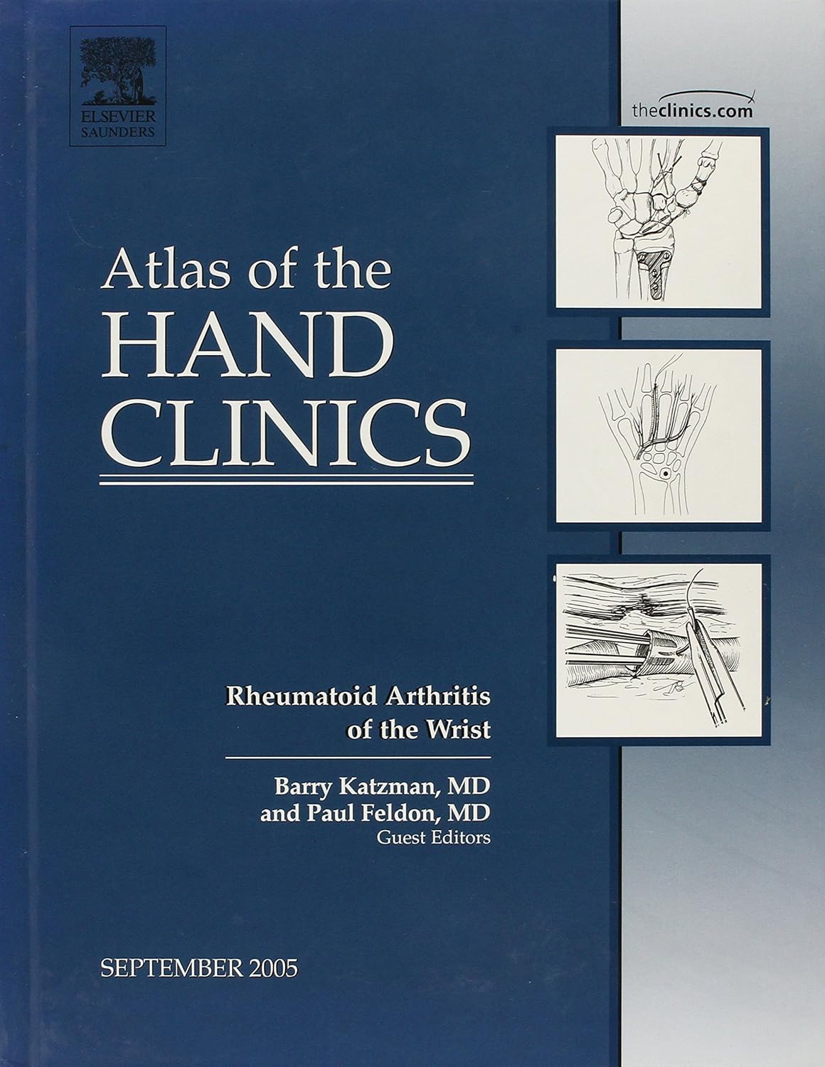 Amazon.com: Rheumatoid Arthritis of the Wrist (Atlas of the Hand ...