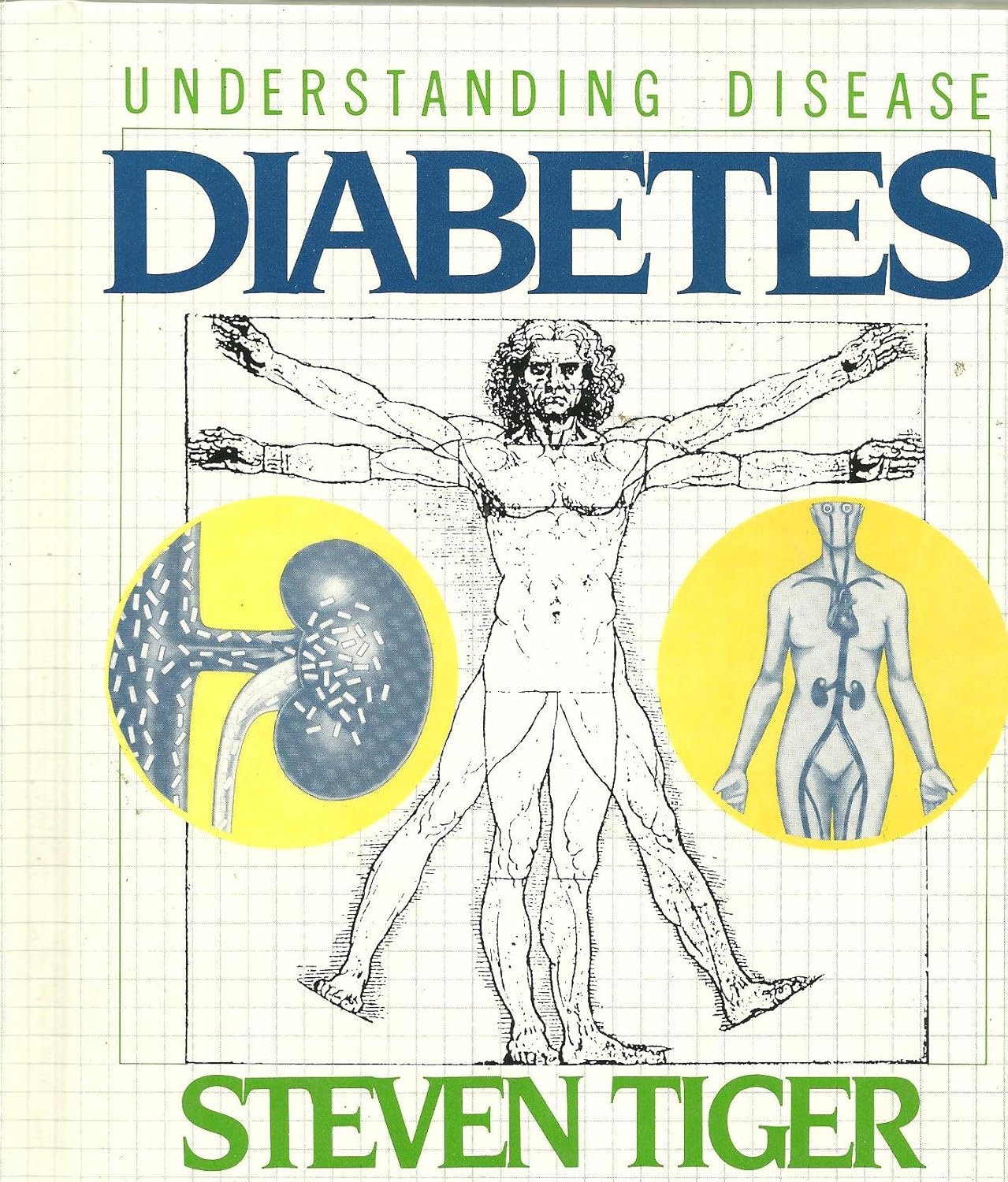 Diabetes (Understanding Disease): Tiger, Steven, Reingold, Michael ...