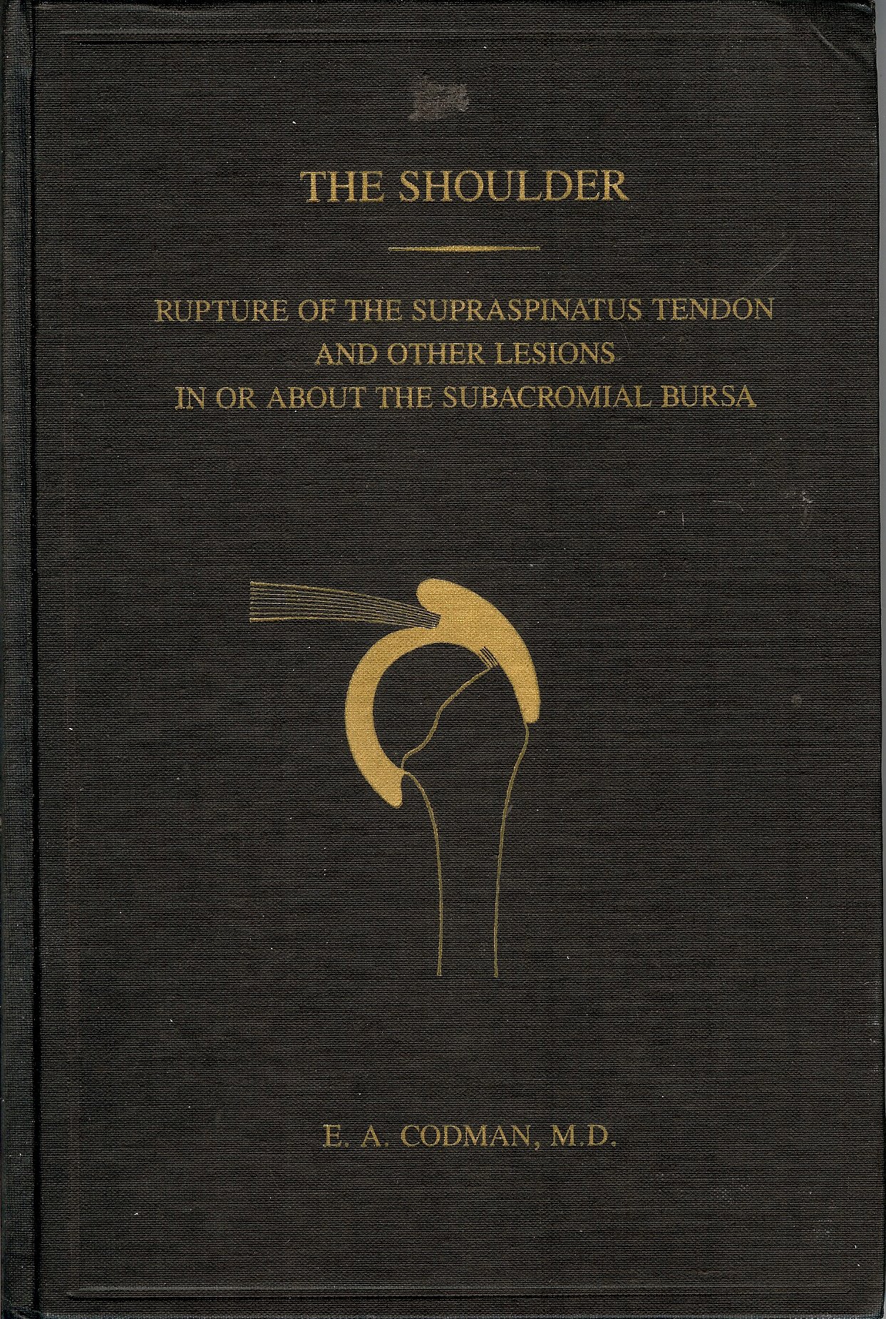 Amazon | Shoulder, Rupture of the Supraspinatus Tension and Other ...