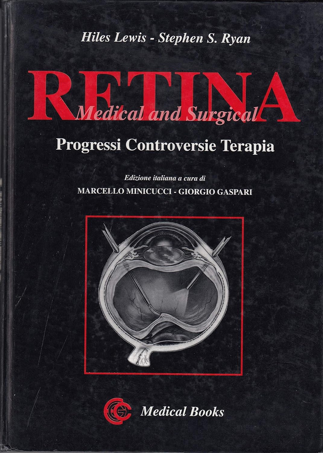 Retina. Medical and Surgical. Progressi, Controversie, Terapia. Vol. 1 ...
