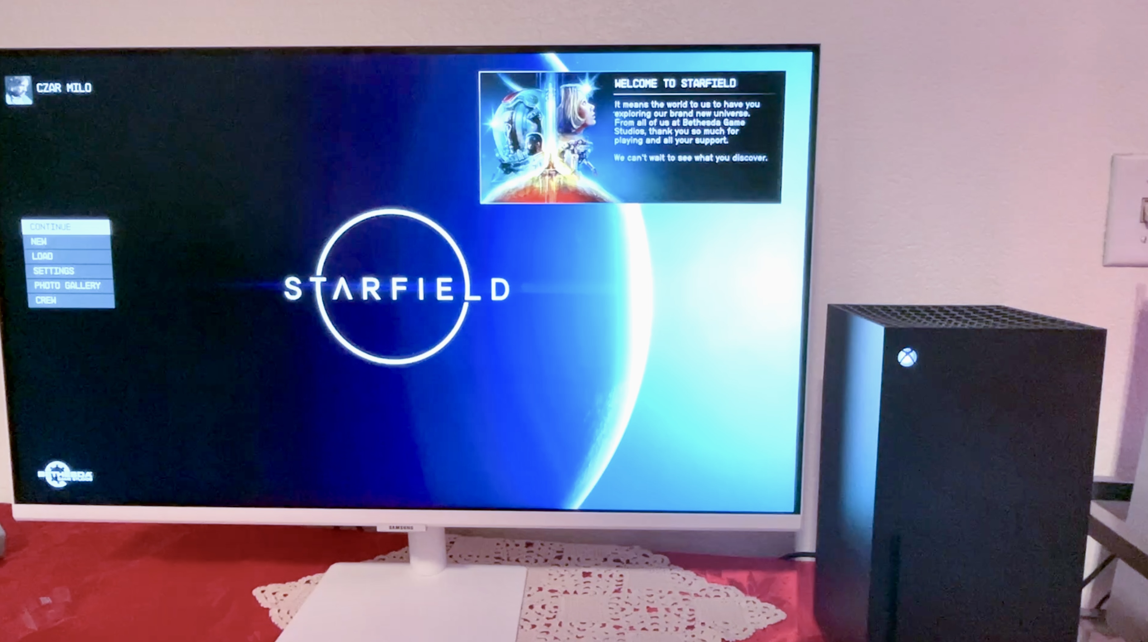 Watch Xbox Series X Starfield Bundle on Amazon Live