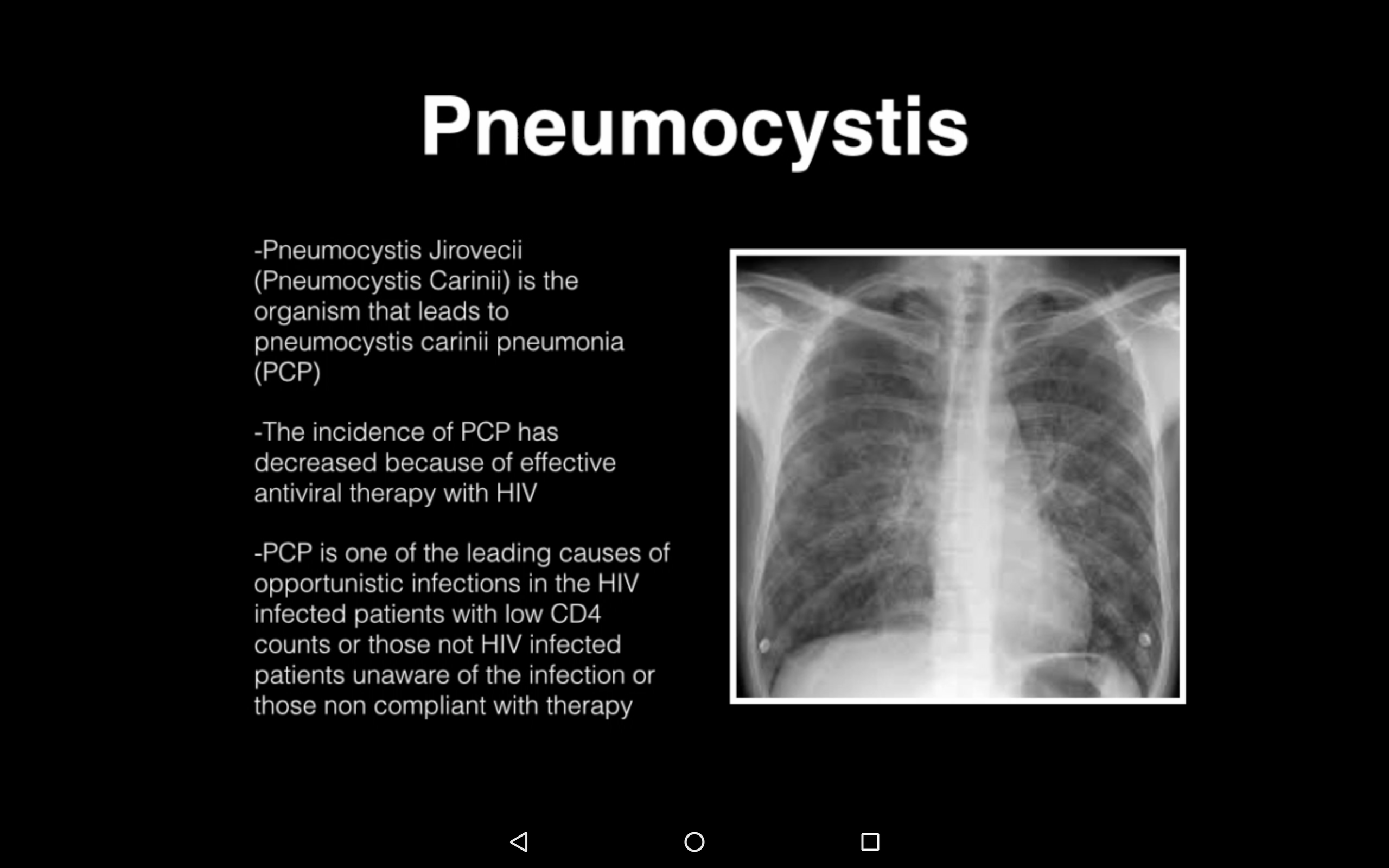 Infectious Disease PANCE PANRE Review Course - App on Amazon Appstore