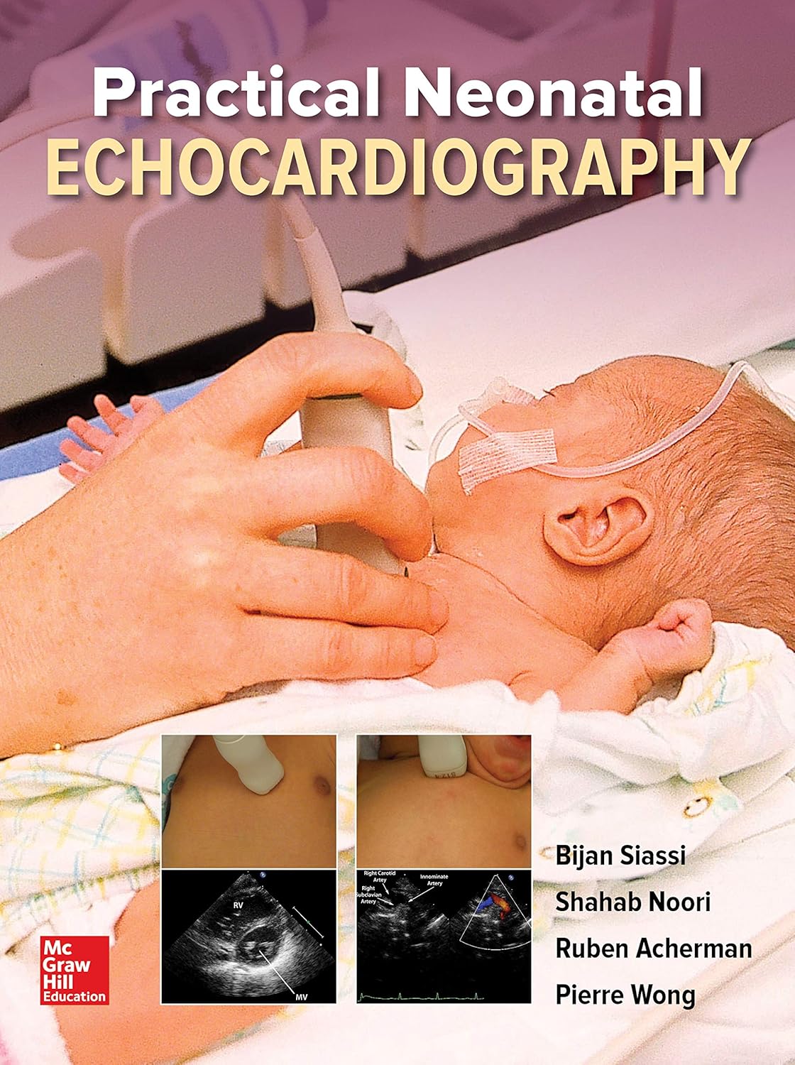 Amazon.com: Practical Neonatal Echocardiography eBook : Siassi, Bijan, Noori, Shahab, Wong ...