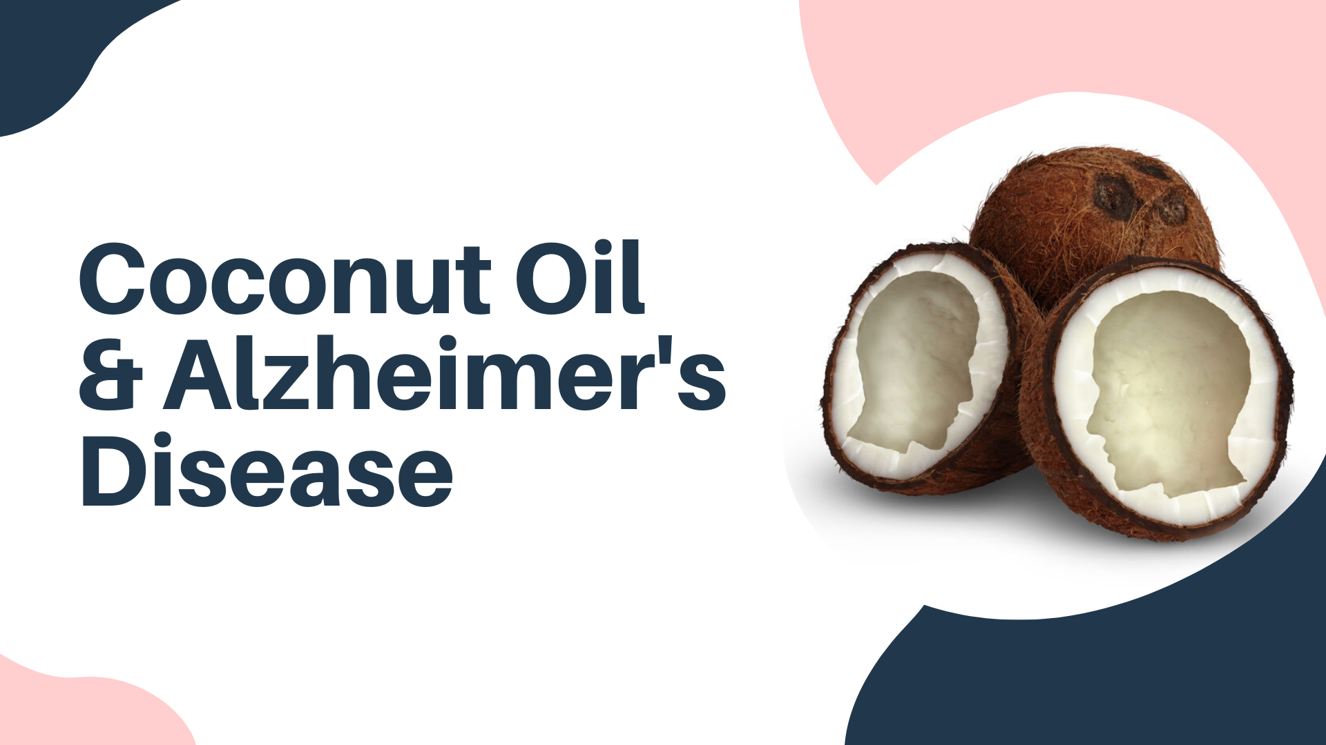 Watch Coconut Oil & Alzheimer's Disease on Amazon Live