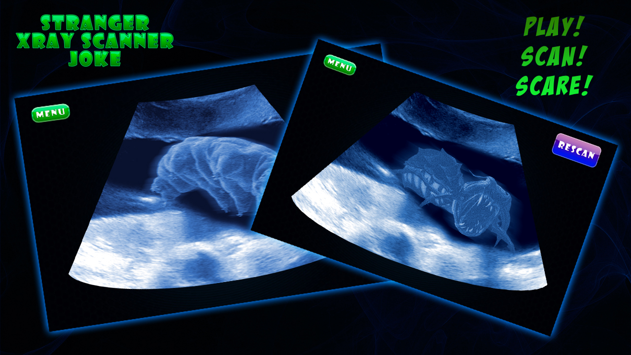 Stranger Xray Scanner Joke - App on Amazon Appstore