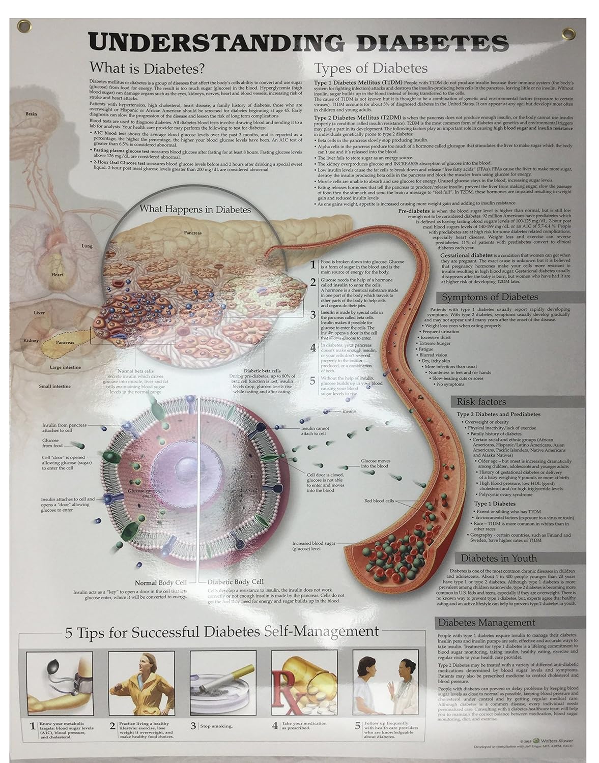 Diabetes Chart Understanding Diabetes : Amazon.in: Industrial & Scientific