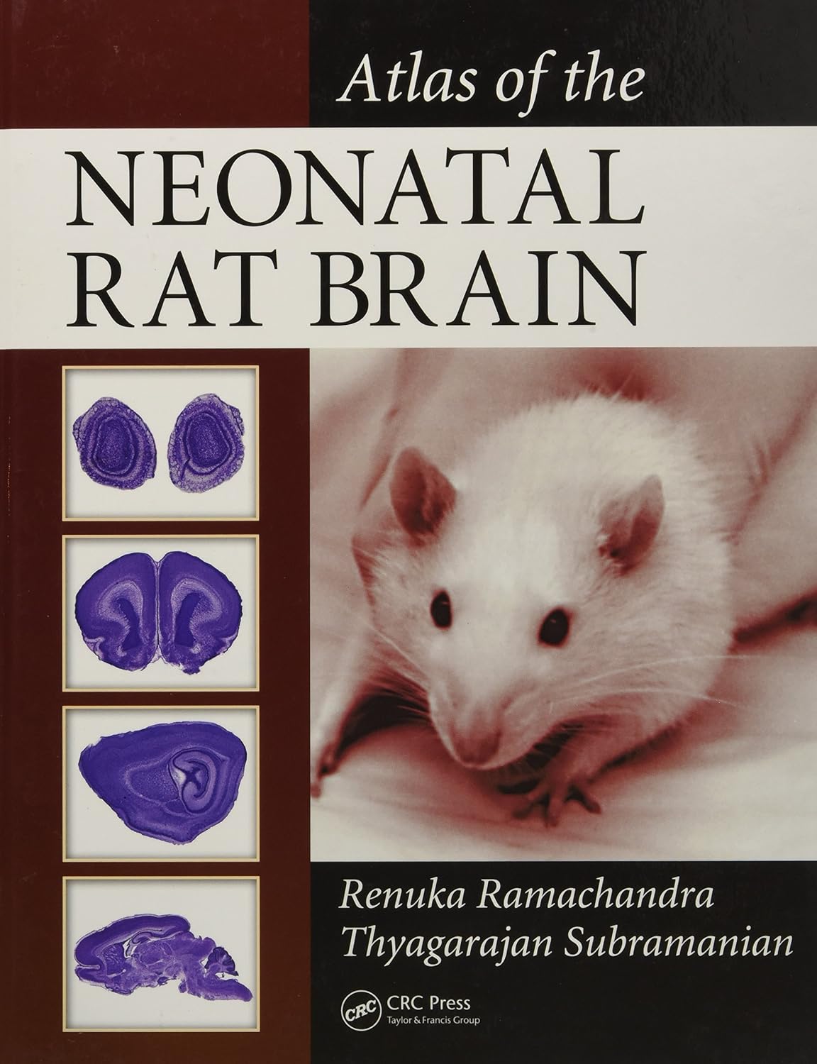 Atlas of the Neonatal Rat Brain: 9781439840122: Medicine & Health ...