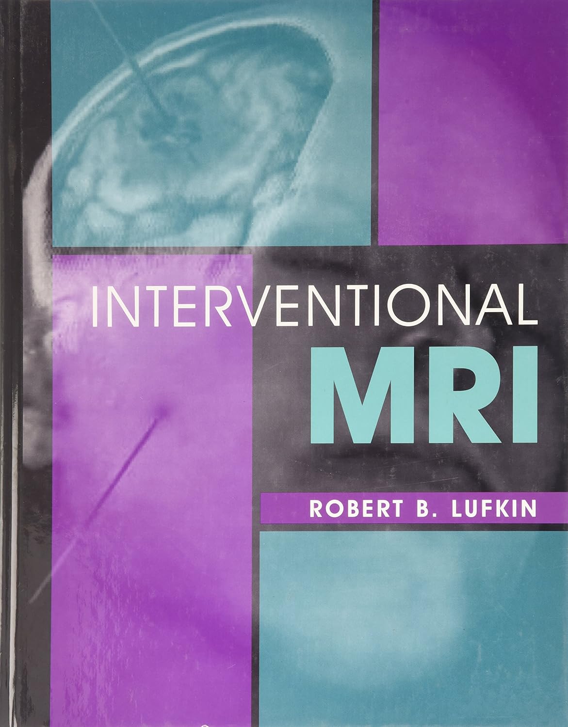 Interventional MRI: 9780849346484: Medicine & Health Science Books ...