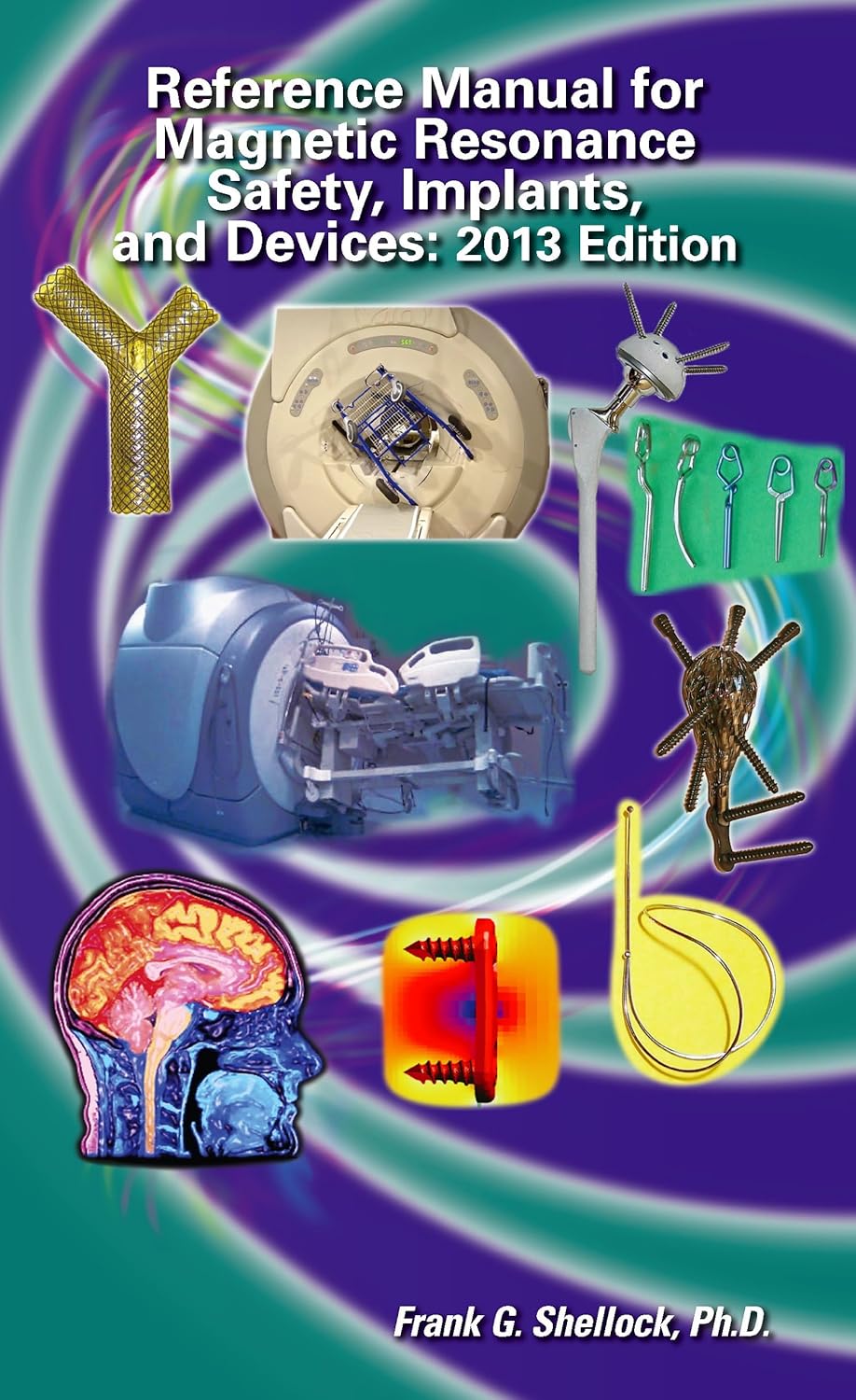 Amazon.com: Reference Manual for Magnetic Resonance Safety, Implants ...